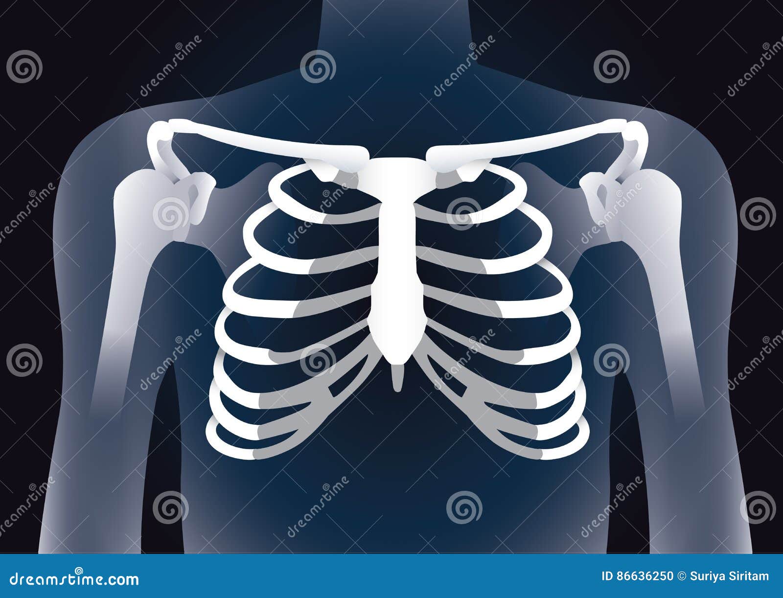 Costochondritis Cartoons, Illustrations & Vector Stock Images - 10 ...