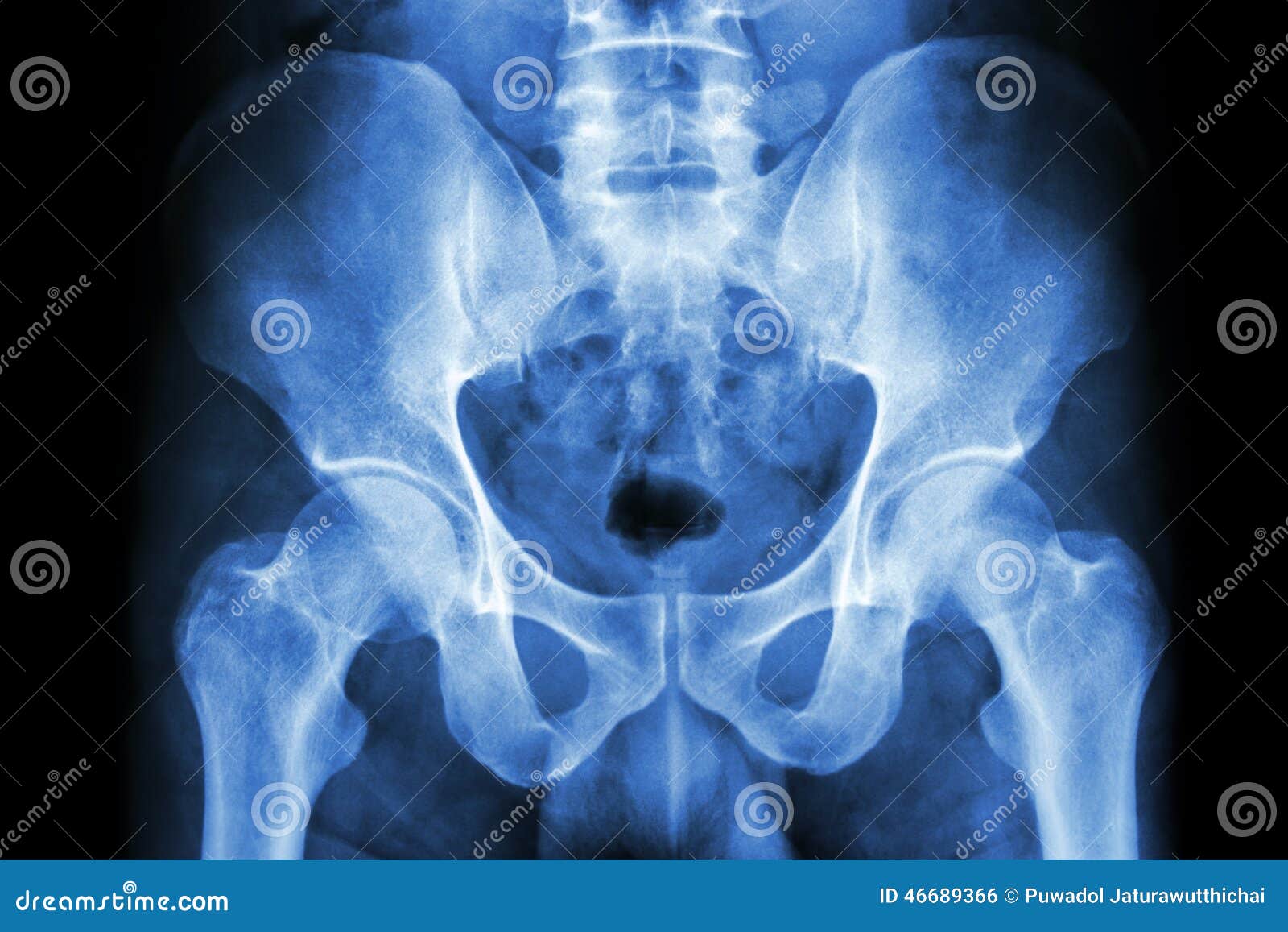 Human S Pelvis and Hip Joints Stock Photo - Image of isolated, black ...