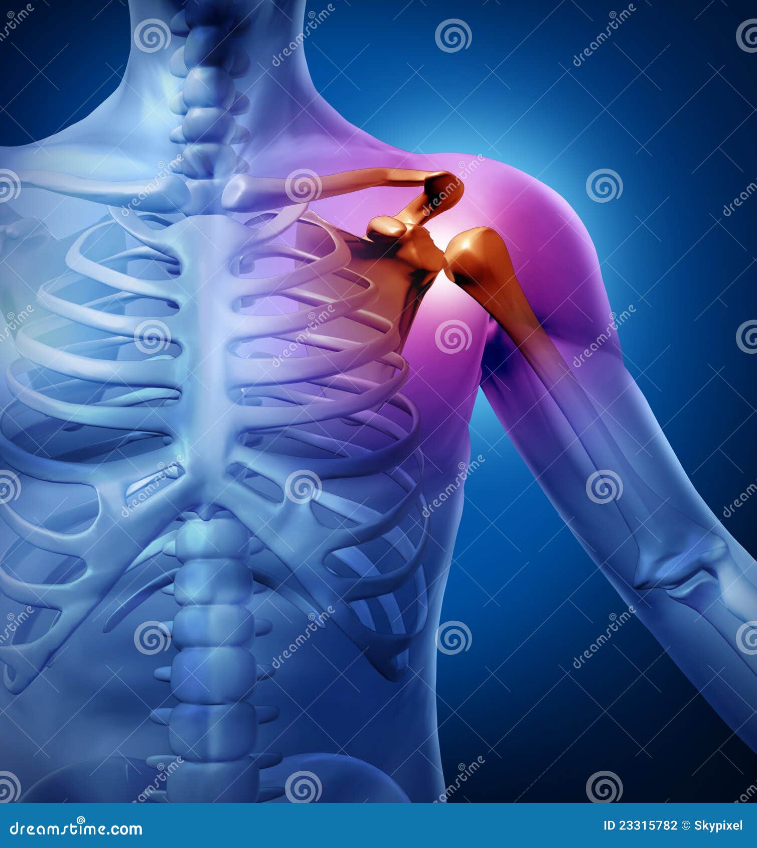 Human Shoulder Pain stock illustration. Illustration of scan - 23315782