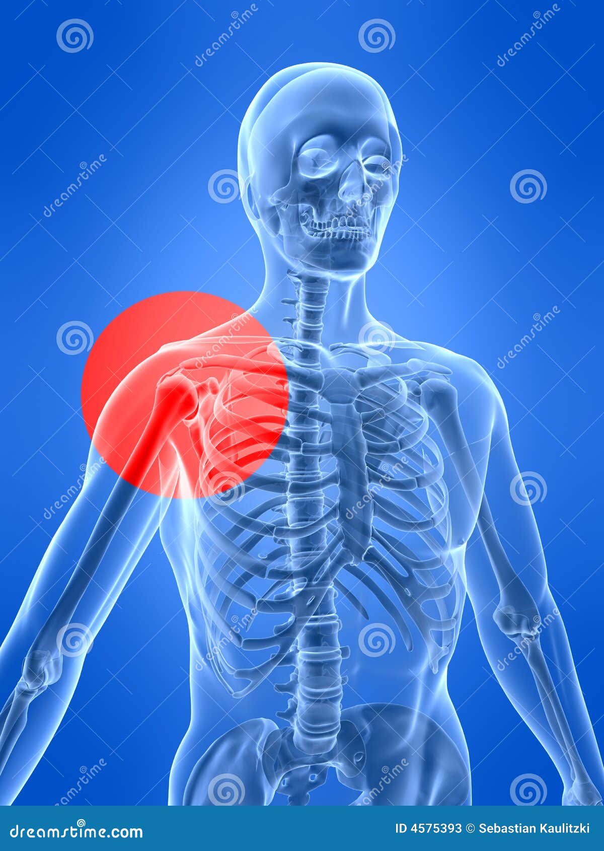 Human shoulder with pain stock illustration. Illustration of back - 4575393