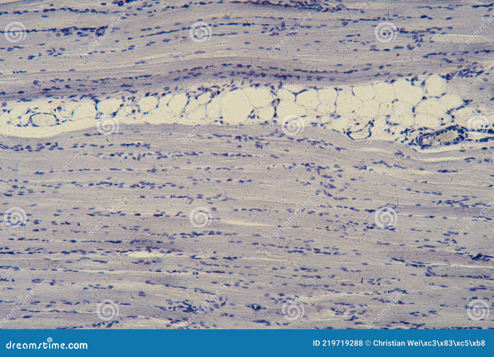 Human Skeletal Muscle Under the Microscope Stock Photo - Image of ...