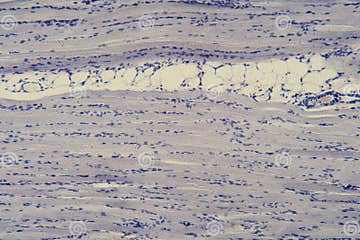 Human Skeletal Muscle Under the Microscope Stock Photo - Image of ...