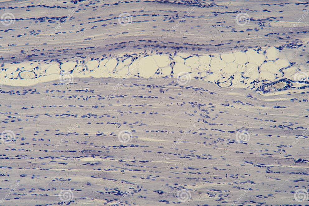 Human Skeletal Muscle Under the Microscope Stock Photo - Image of ...