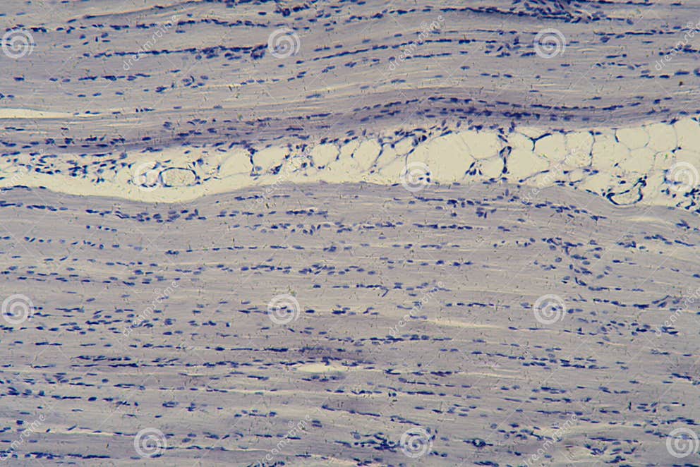 Human Skeletal Muscle Under the Microscope Stock Photo - Image of slide ...