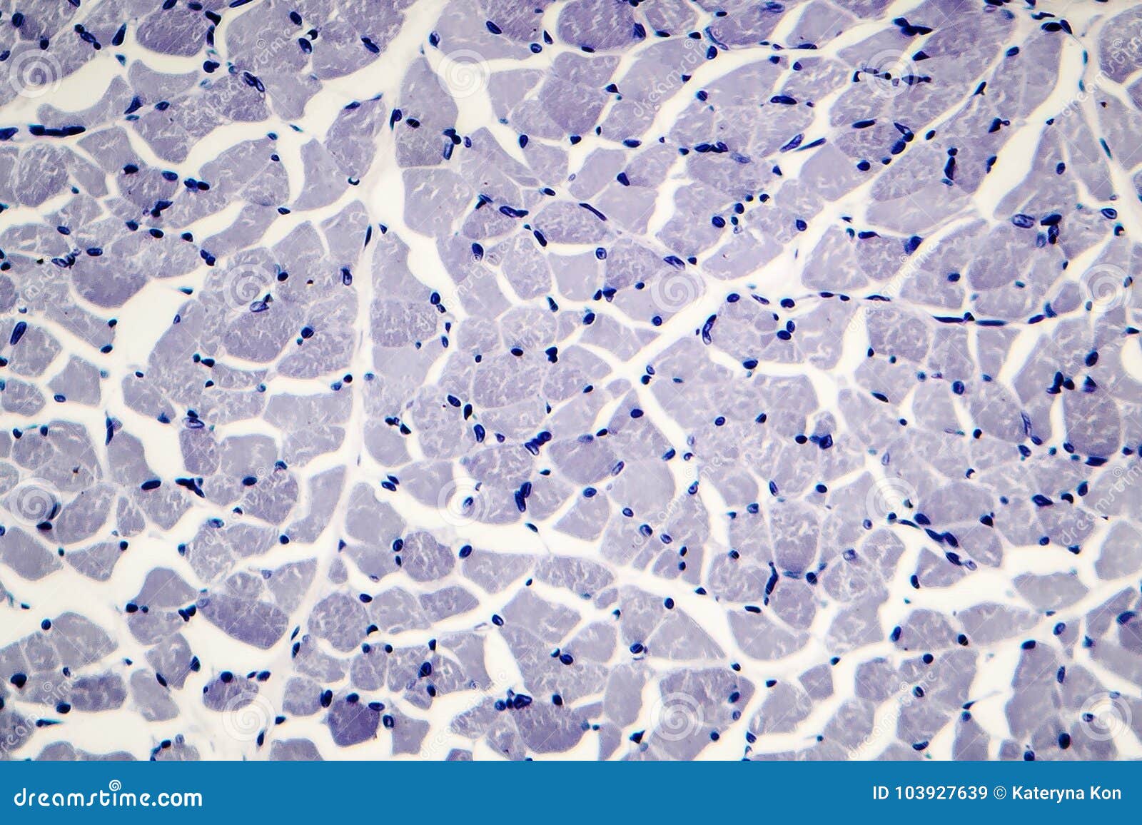 Human Skeletal Muscle Under Microscope View For Education Pathology ...