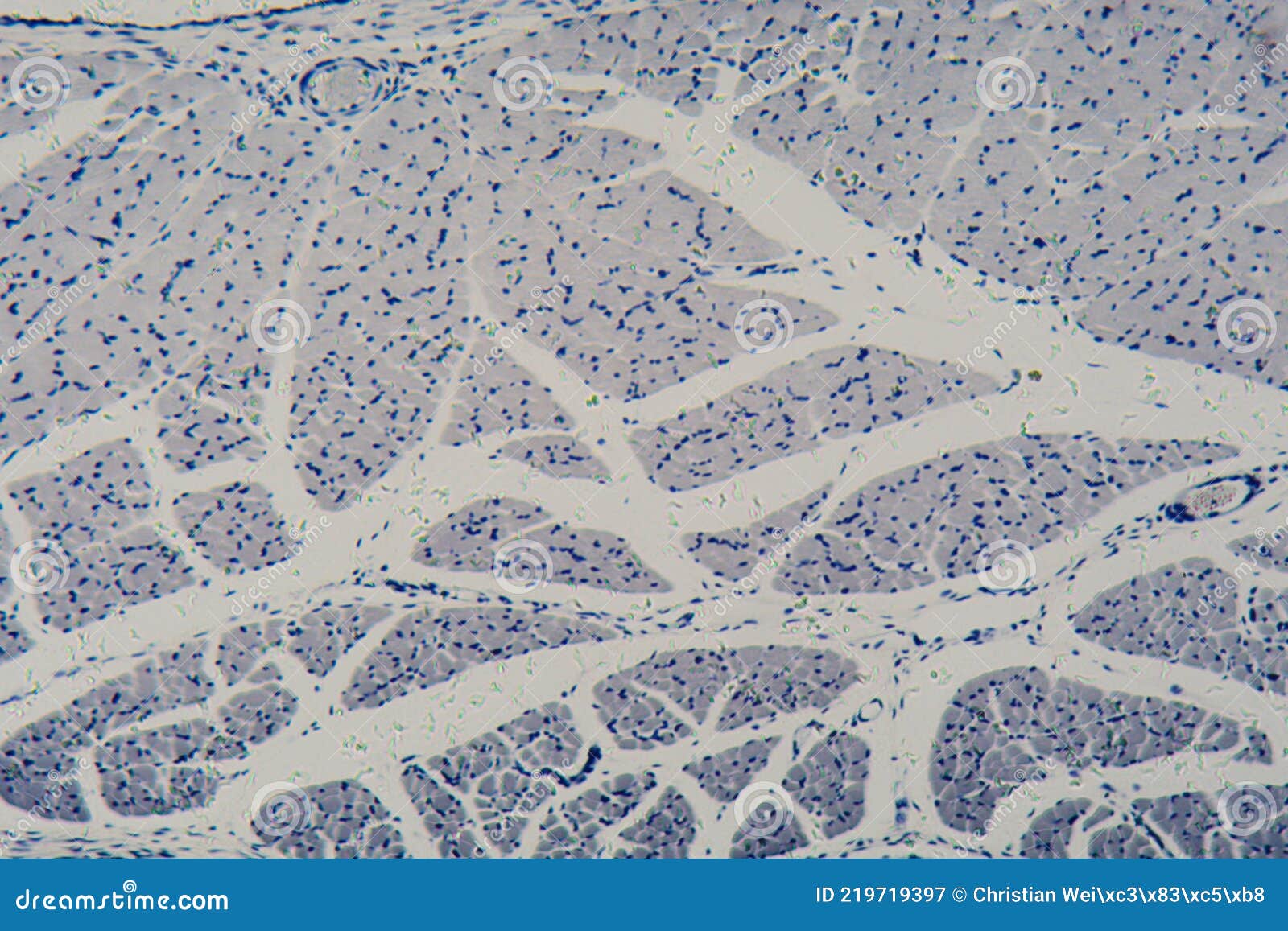 Human Skeletal Muscle Under the Microscope Stock Image - Image of slide ...