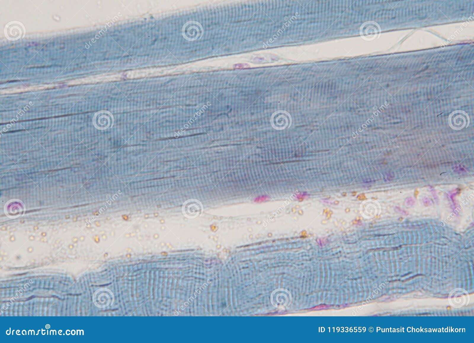 Human Skeletal Muscle Under Microscope View for Education Histology ...