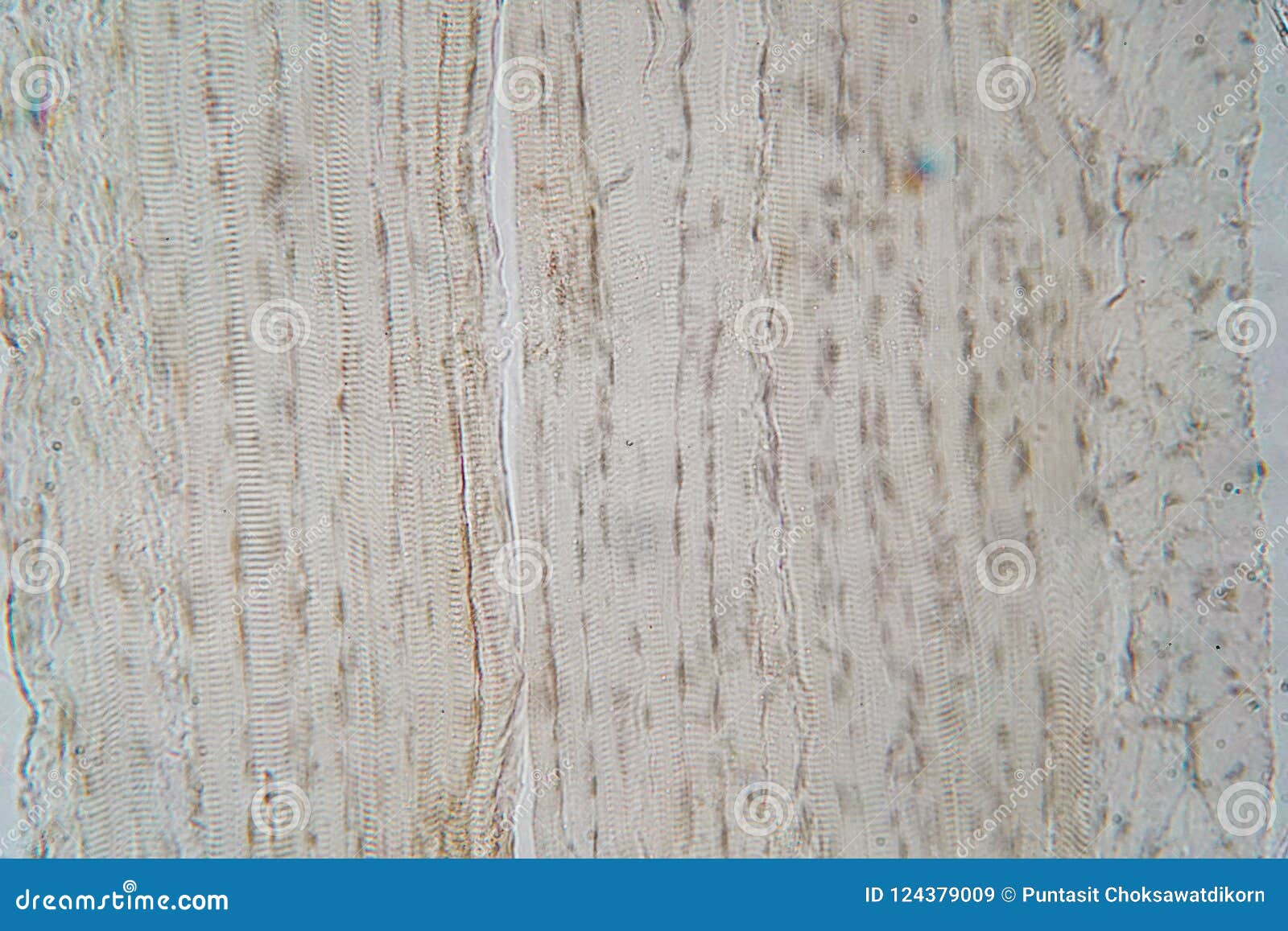 Human Skeletal Muscle Under Microscope View for Education Histology ...