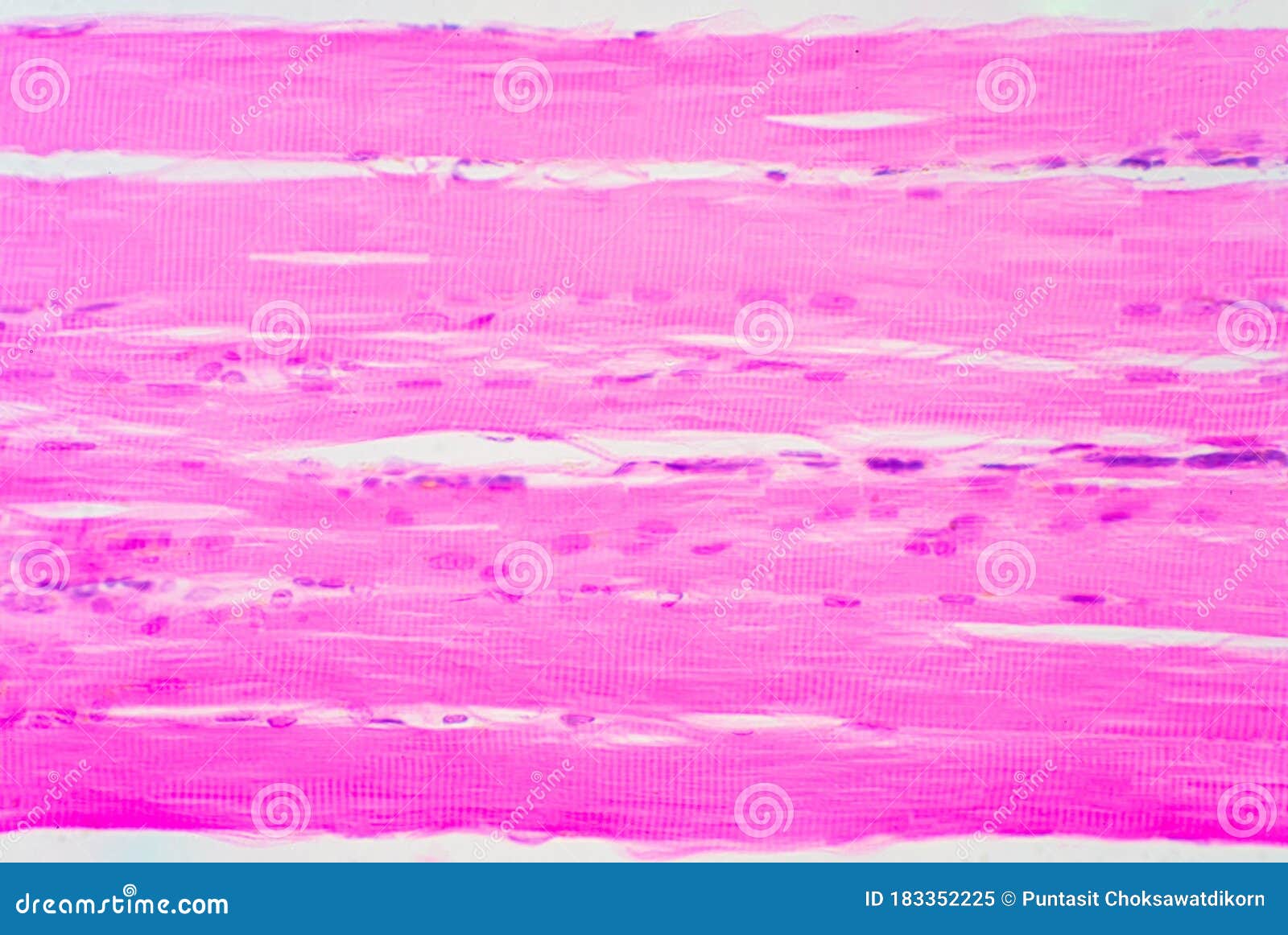 Human Skeletal Muscle Under Microscope View for Education Pathology ... Human Skeletal Muscle Under Microscope View for Education Pathology ...
