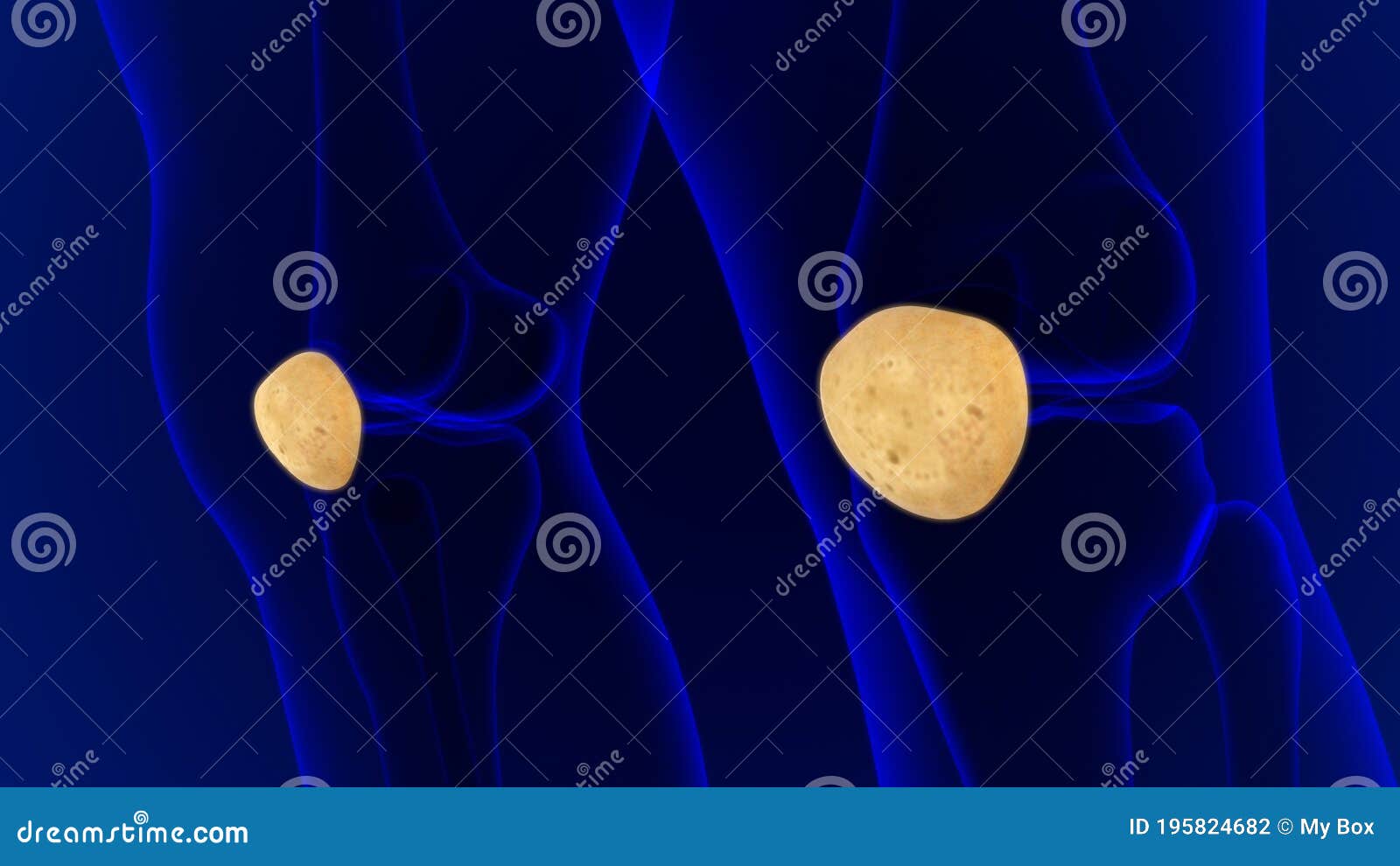 Human Skeleton Anatomy Patella Bone 3D Rendering Stock Illustration ...