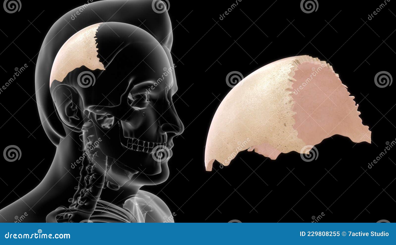 Human Skeleton Skull Bone - Parietal Bone Stock Illustration ...