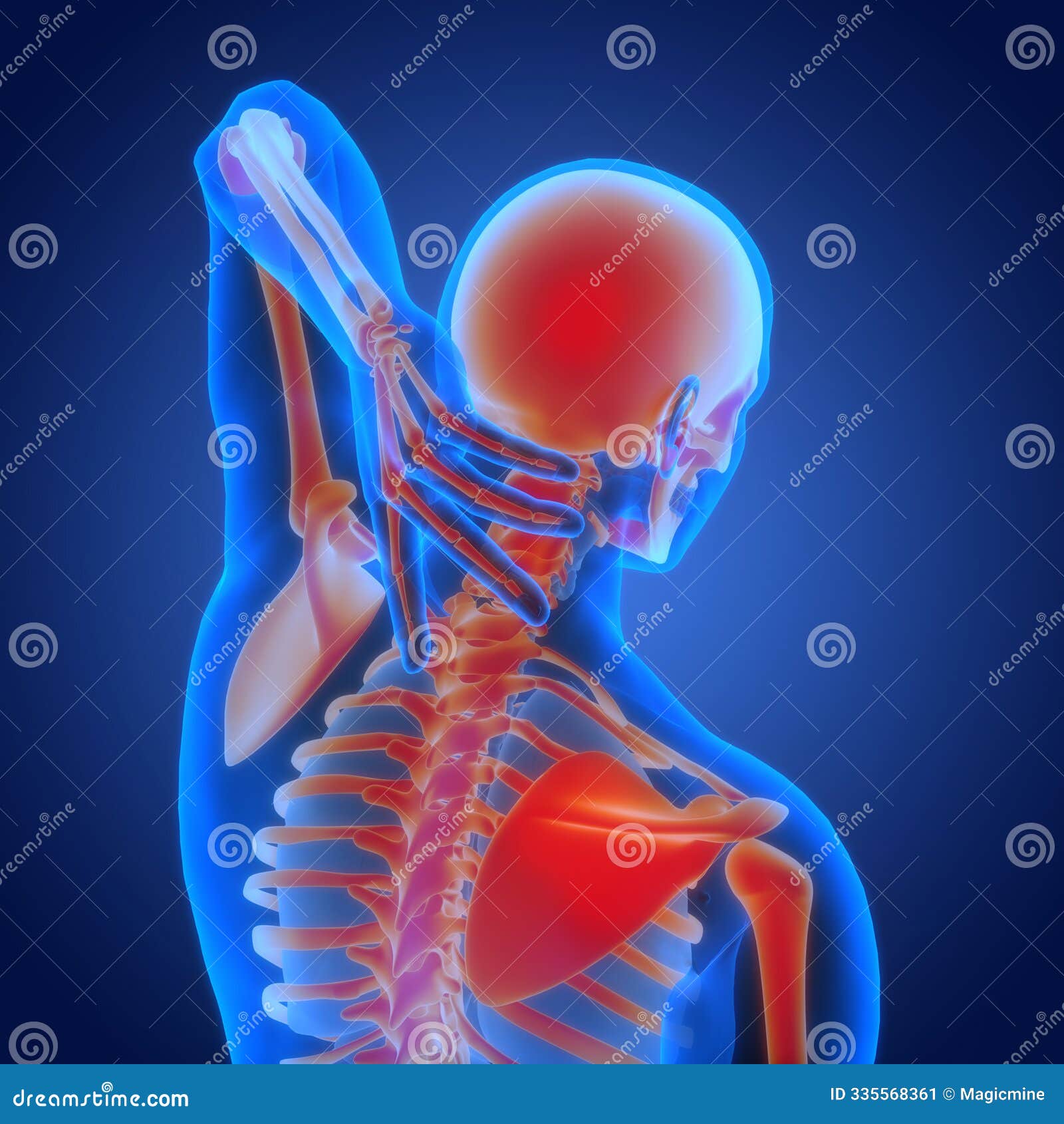 Bone And Joints Of The Shoulder Anatomy. Vector Illustration ... Bone And Joints Of The Shoulder Anatomy. Vector Illustration ...