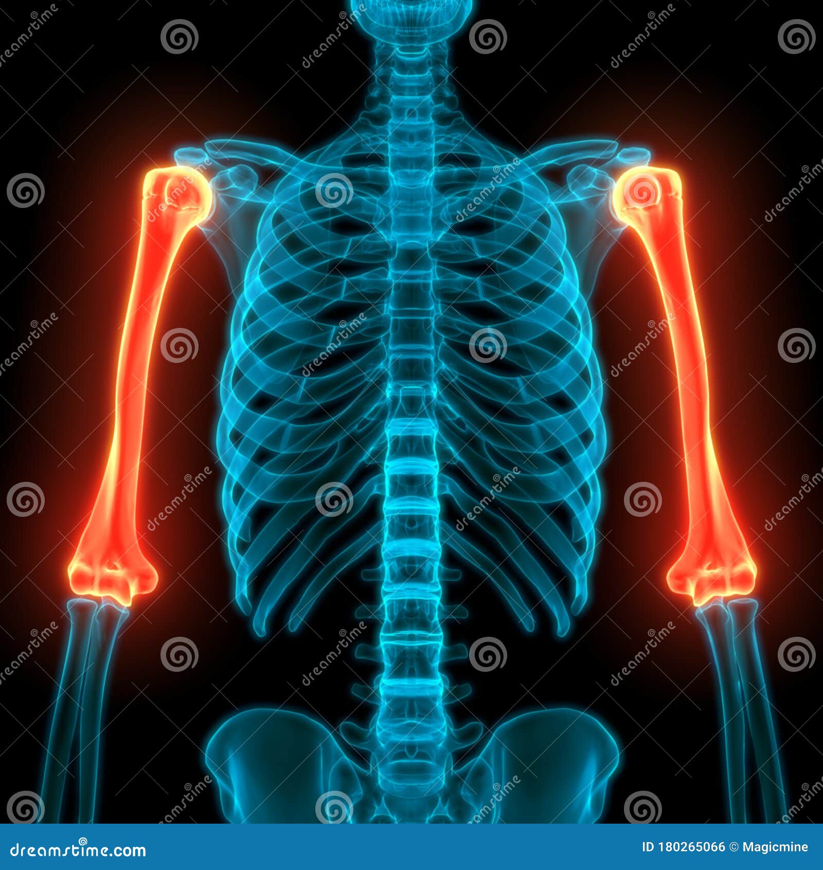 Humerus X-ray. Osteology Of The Human Skeleton, Arm Or Upper Limb Bones ...