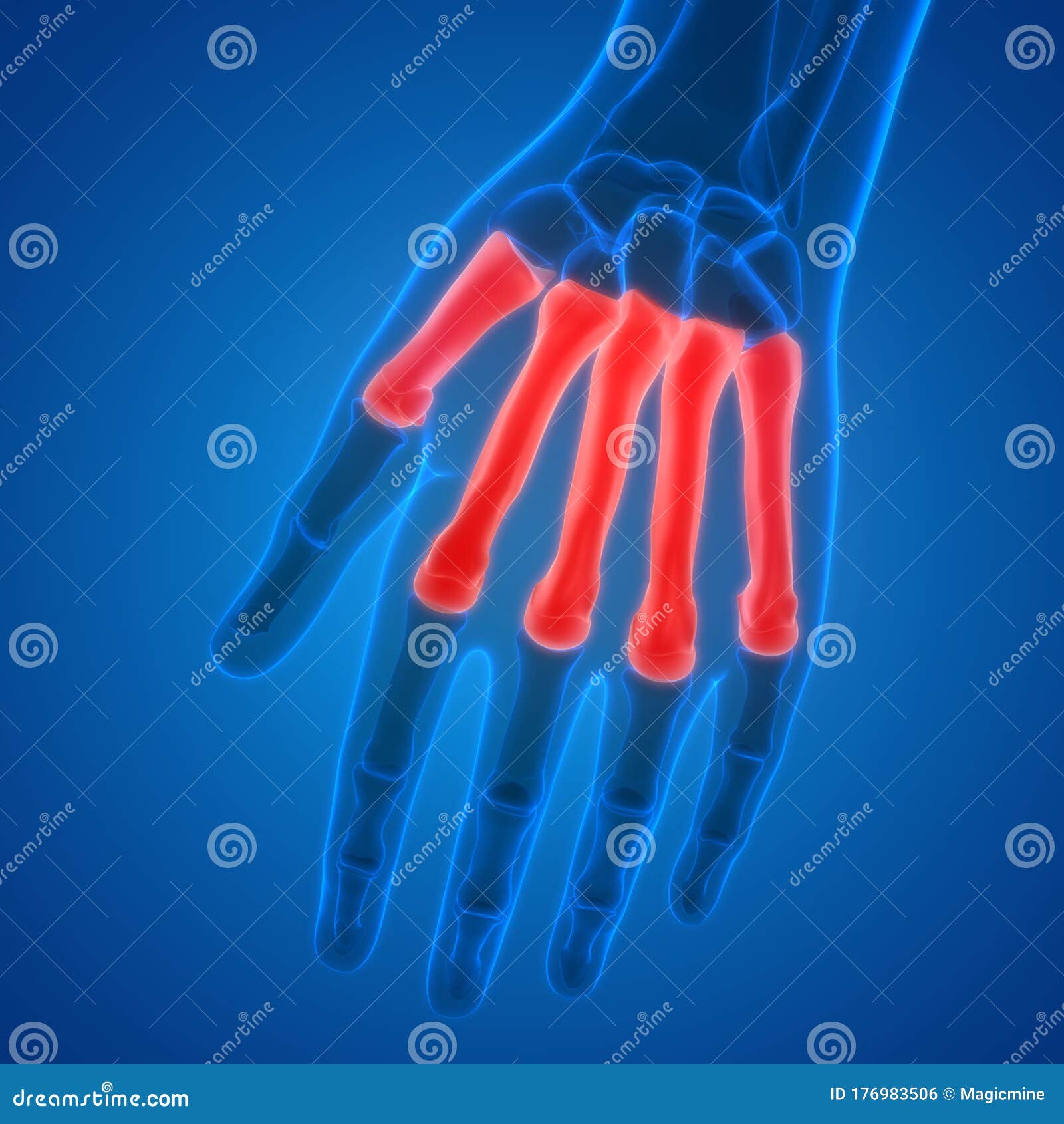 Human Skeleton System Metacarpal Bone Joints Anatomy Stock Illustration ...