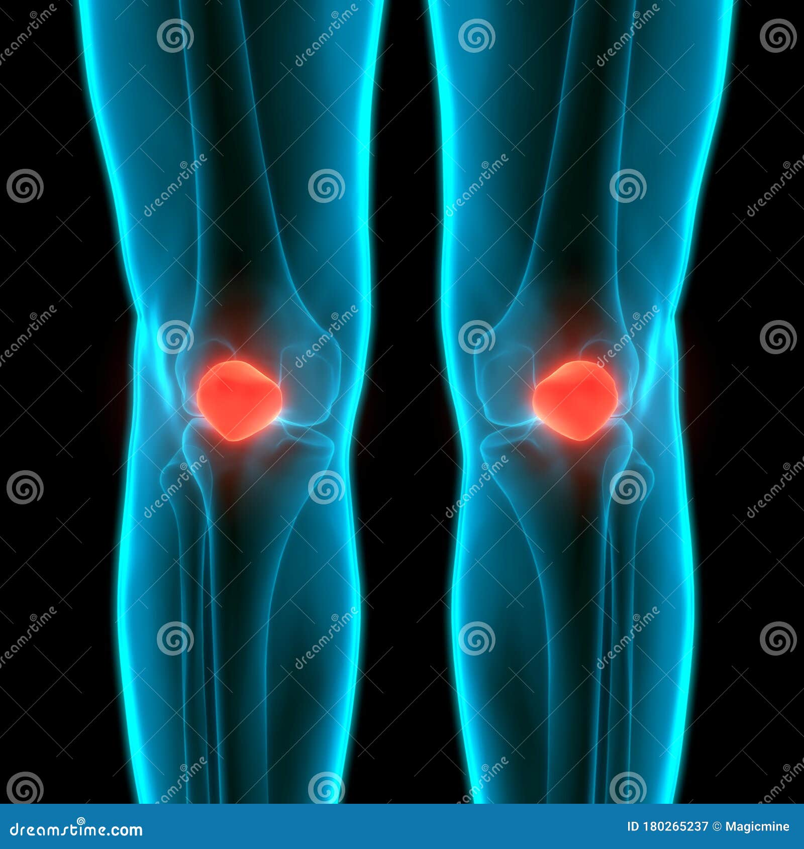 Patella Anatomy Knee Bone With Ciculatory System Royalty-Free Stock ...