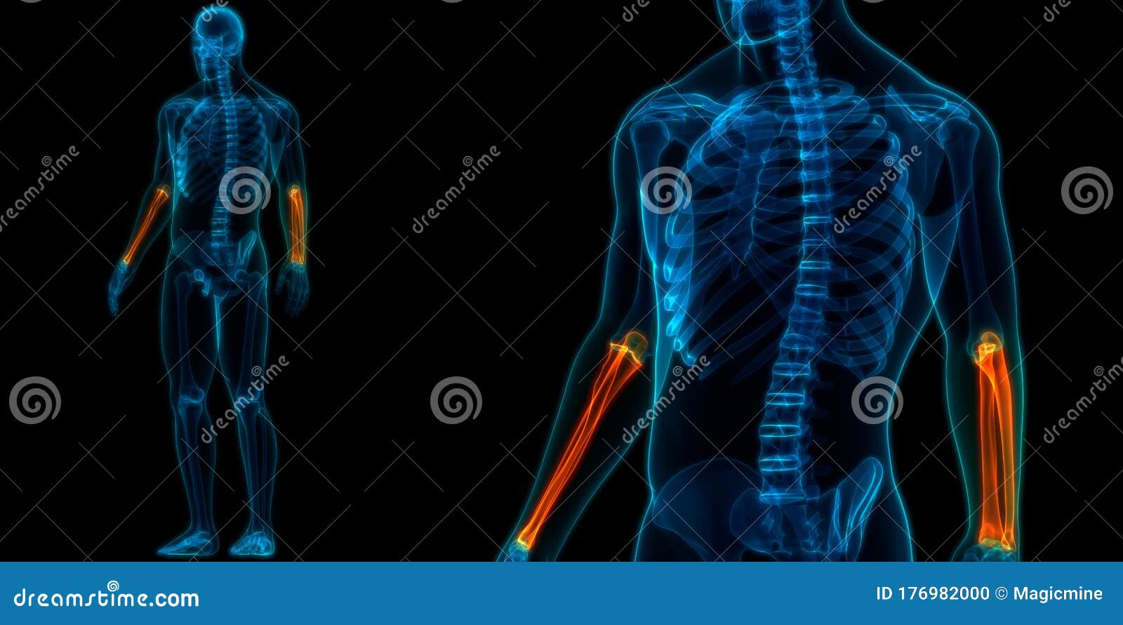 Human Skeleton System Radius Ulna Bone Joints Anatomy Stock ...