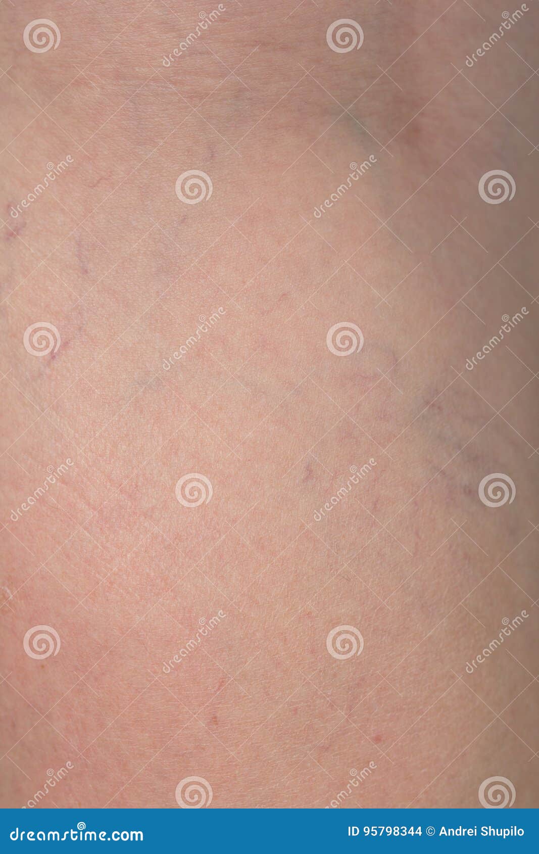 Human Skin As a Background. Macro Stock Photo - Image of detail ...