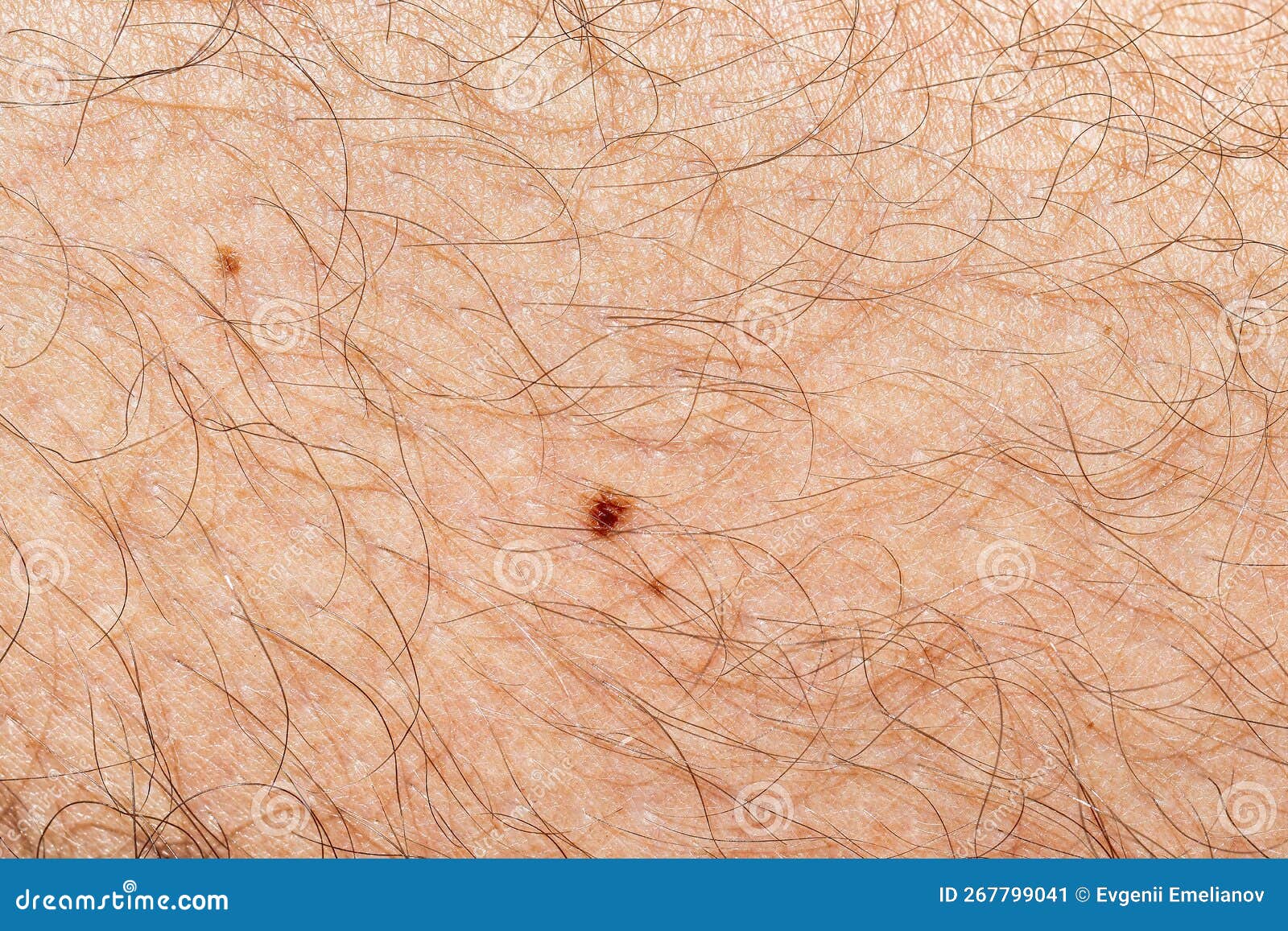 Human Skin Covered with Hair. Stock Image - Image of male, caucasian ...