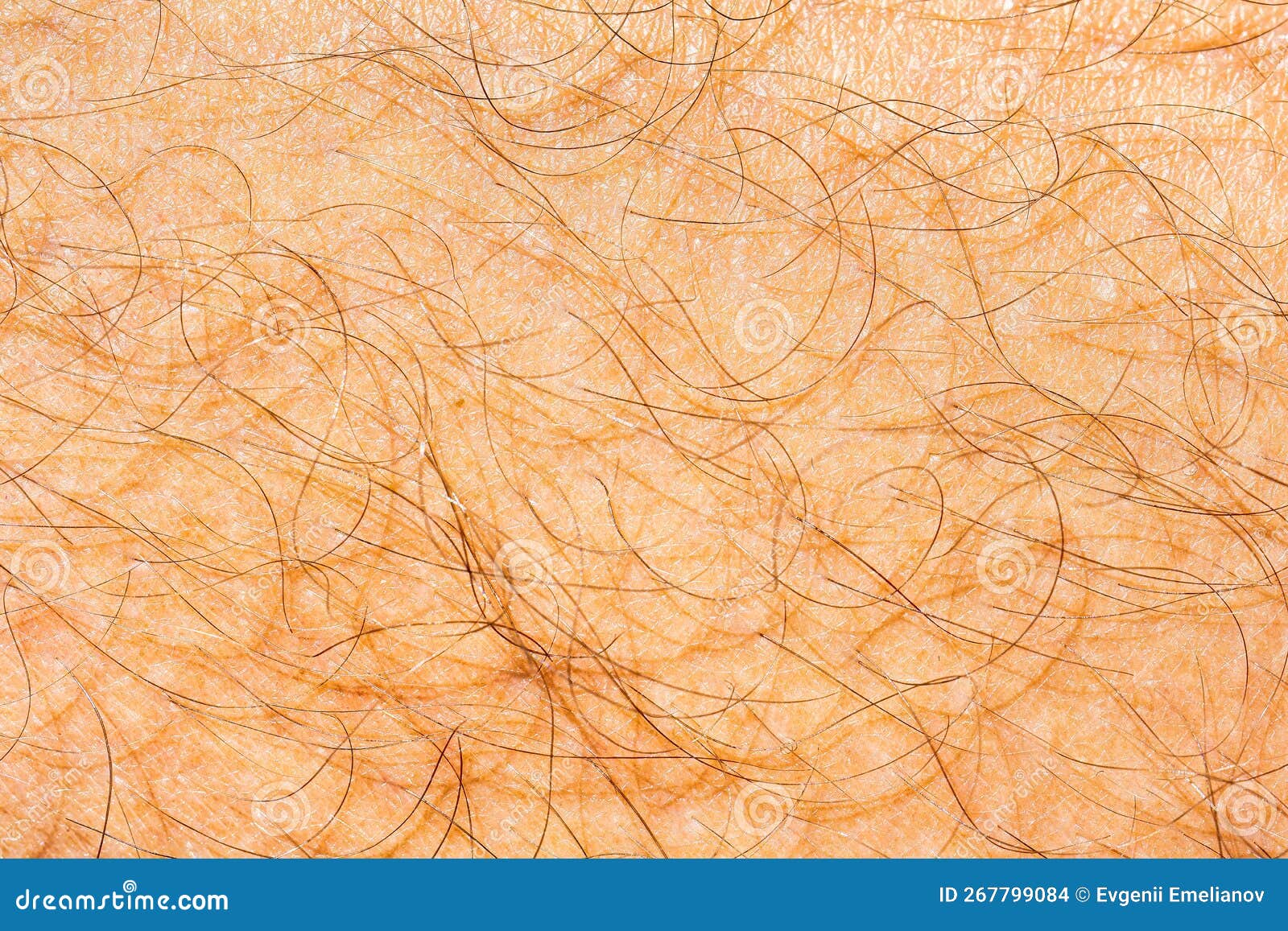 Human Skin Covered with Hair. Stock Photo - Image of pattern ...