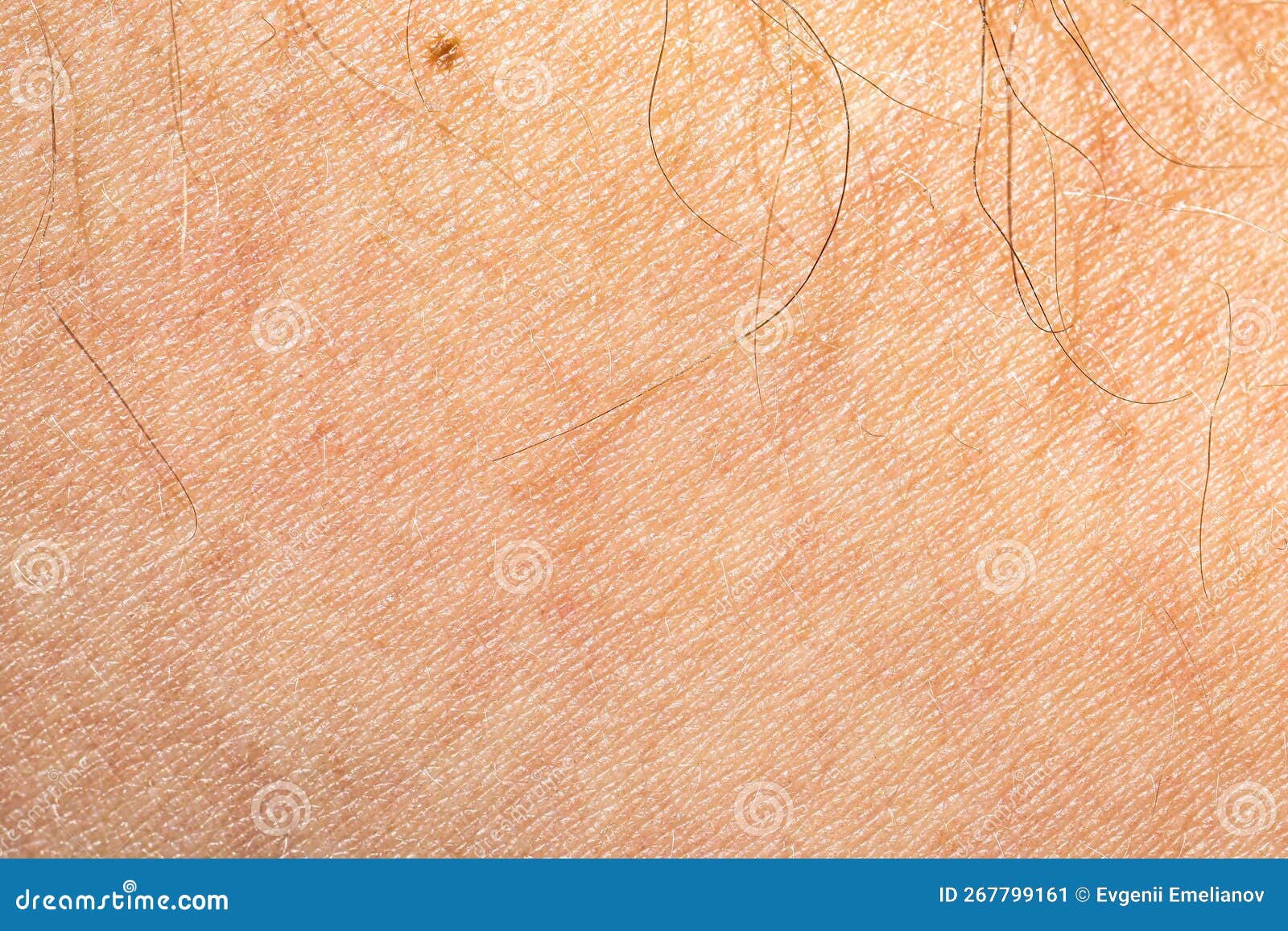 Human Skin Covered with Hair. Stock Image - Image of macro, hand: 267799161