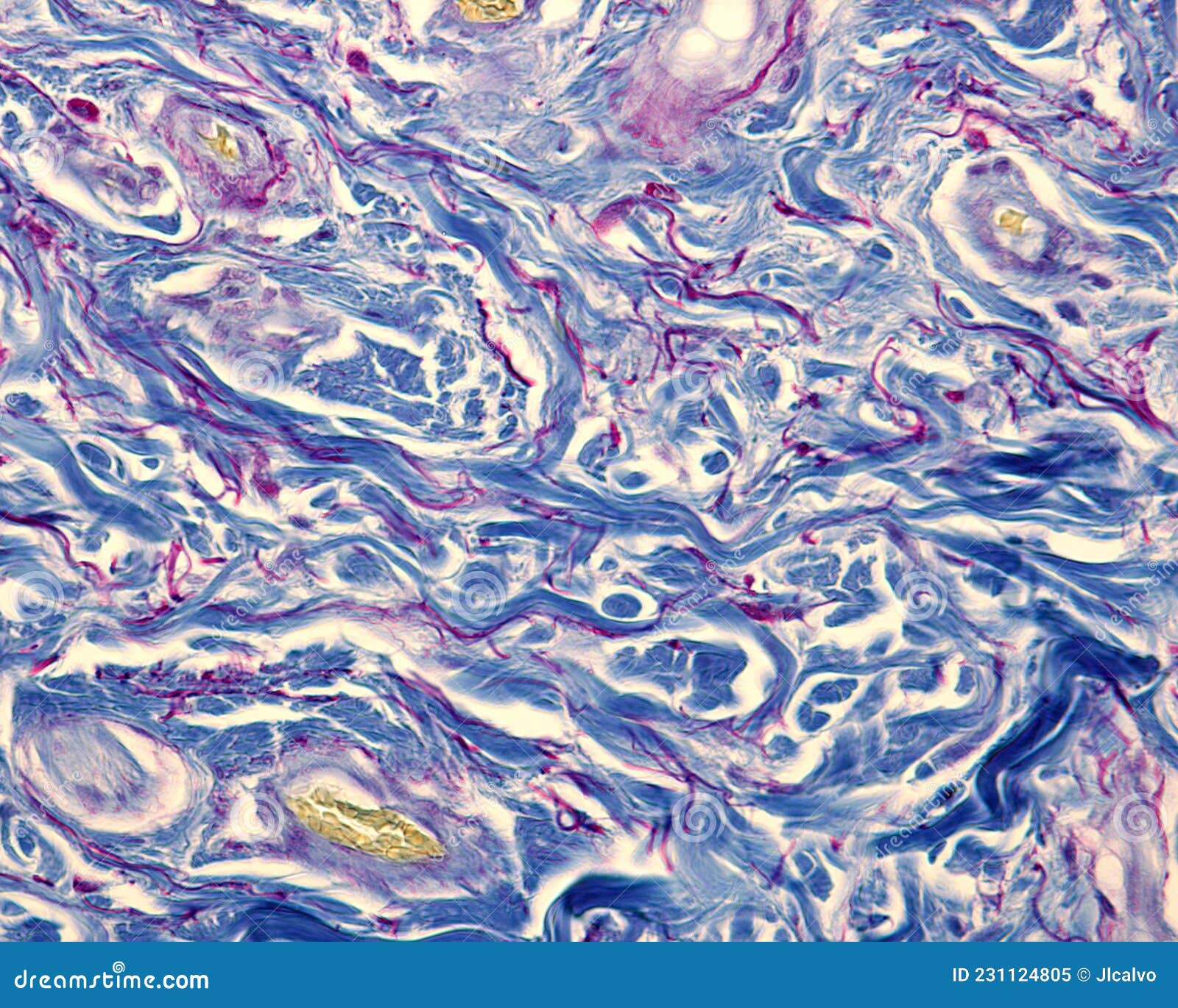 Human Skin Dermis. Elastic Fibers Stock Image - Image of method ...