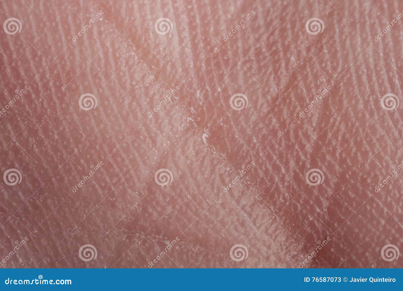 Human skin stock image. Image of fingerprints, lines - 76587073