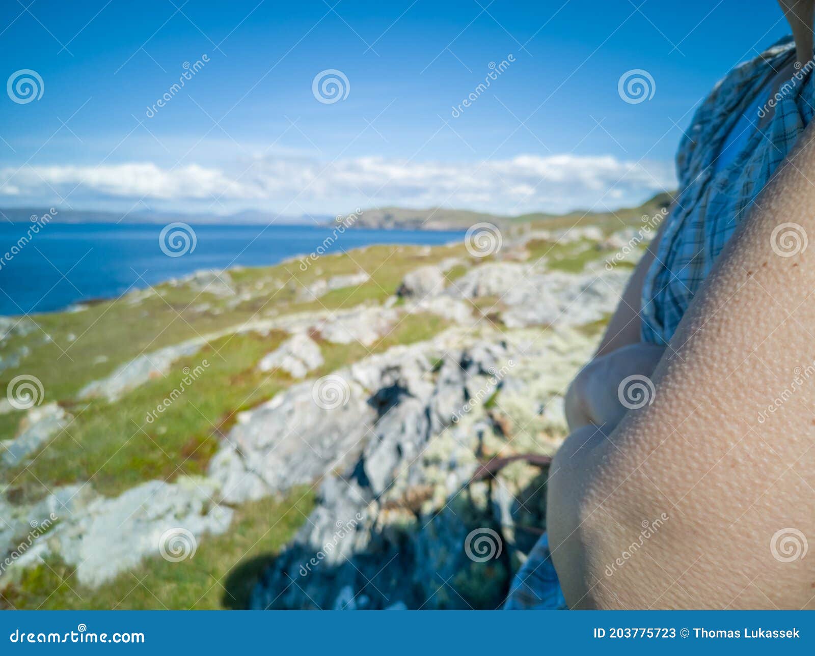 Human Skin with Goosebumps from the Cold Stock Image - Image of freeze ...