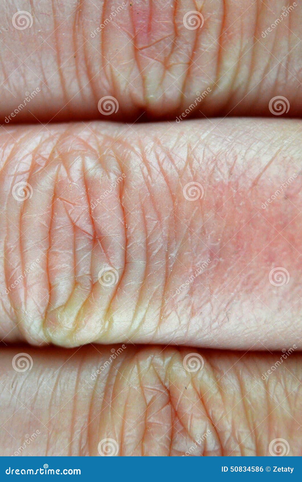 Human skin macro stock photo. Image of border, healthcare - 50834586