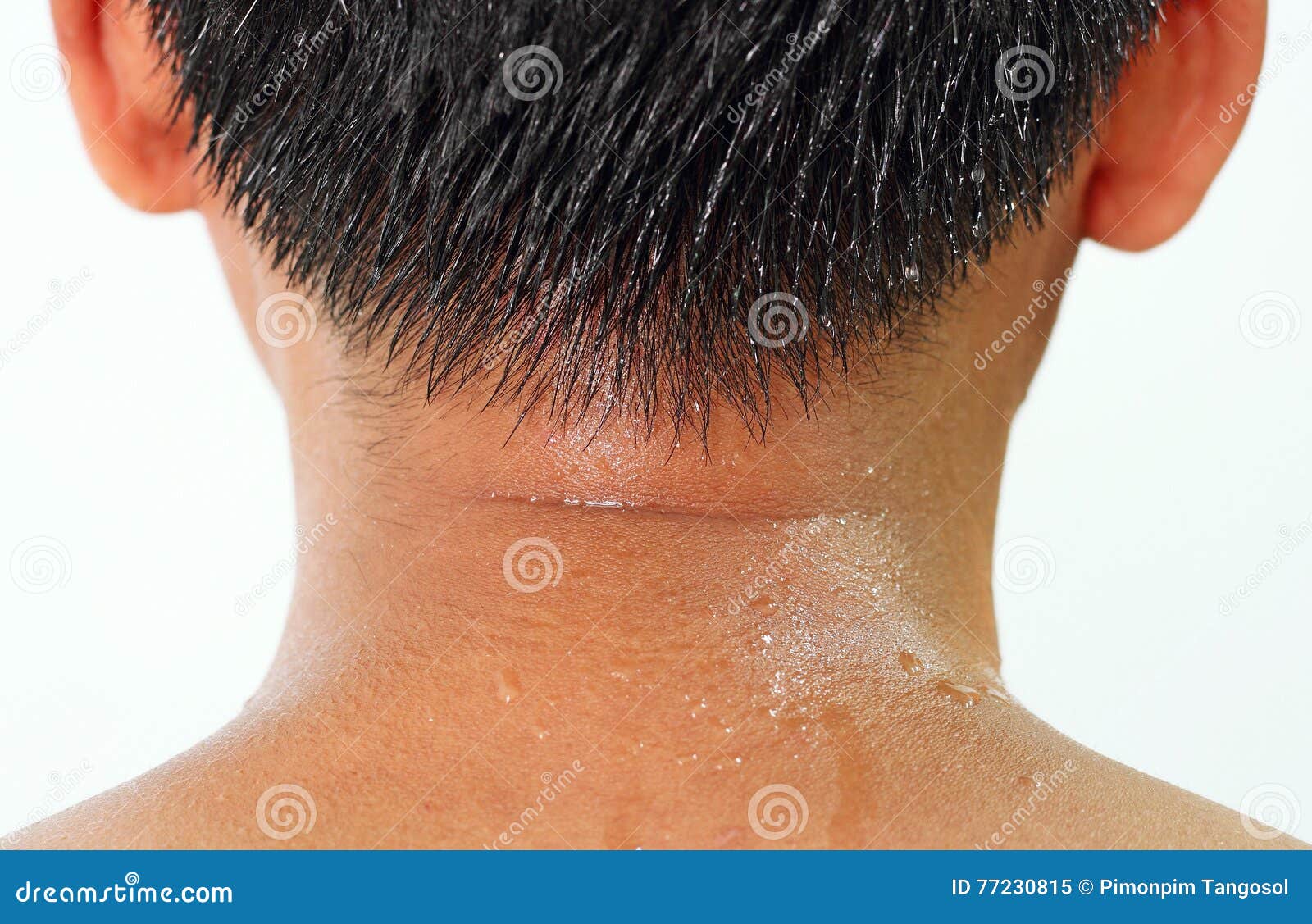 Human Skin and Sweat stock image. Image of closeup, drop - 77230815