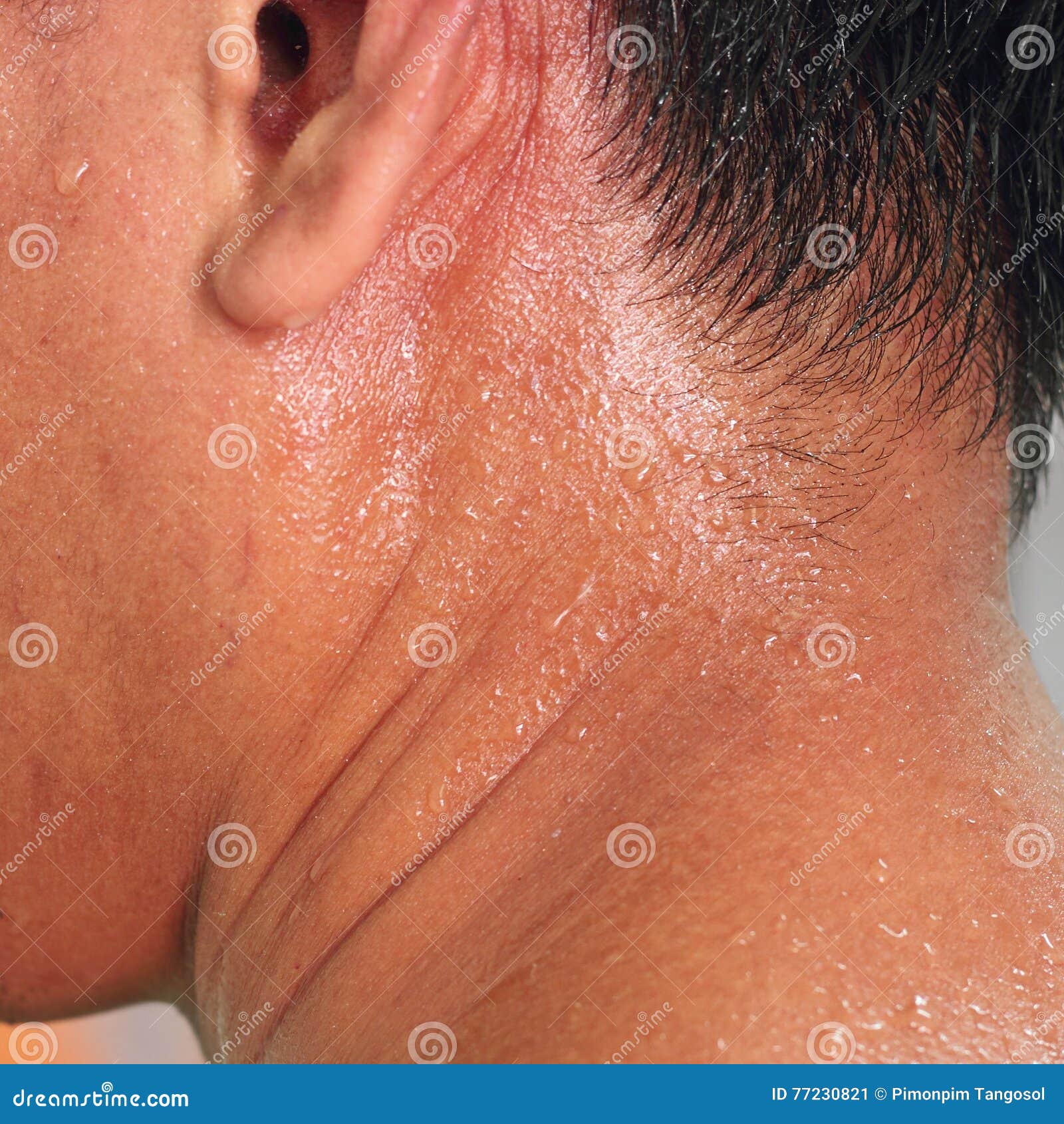 Human Skin and Sweat stock image. Image of science, peel - 77230821