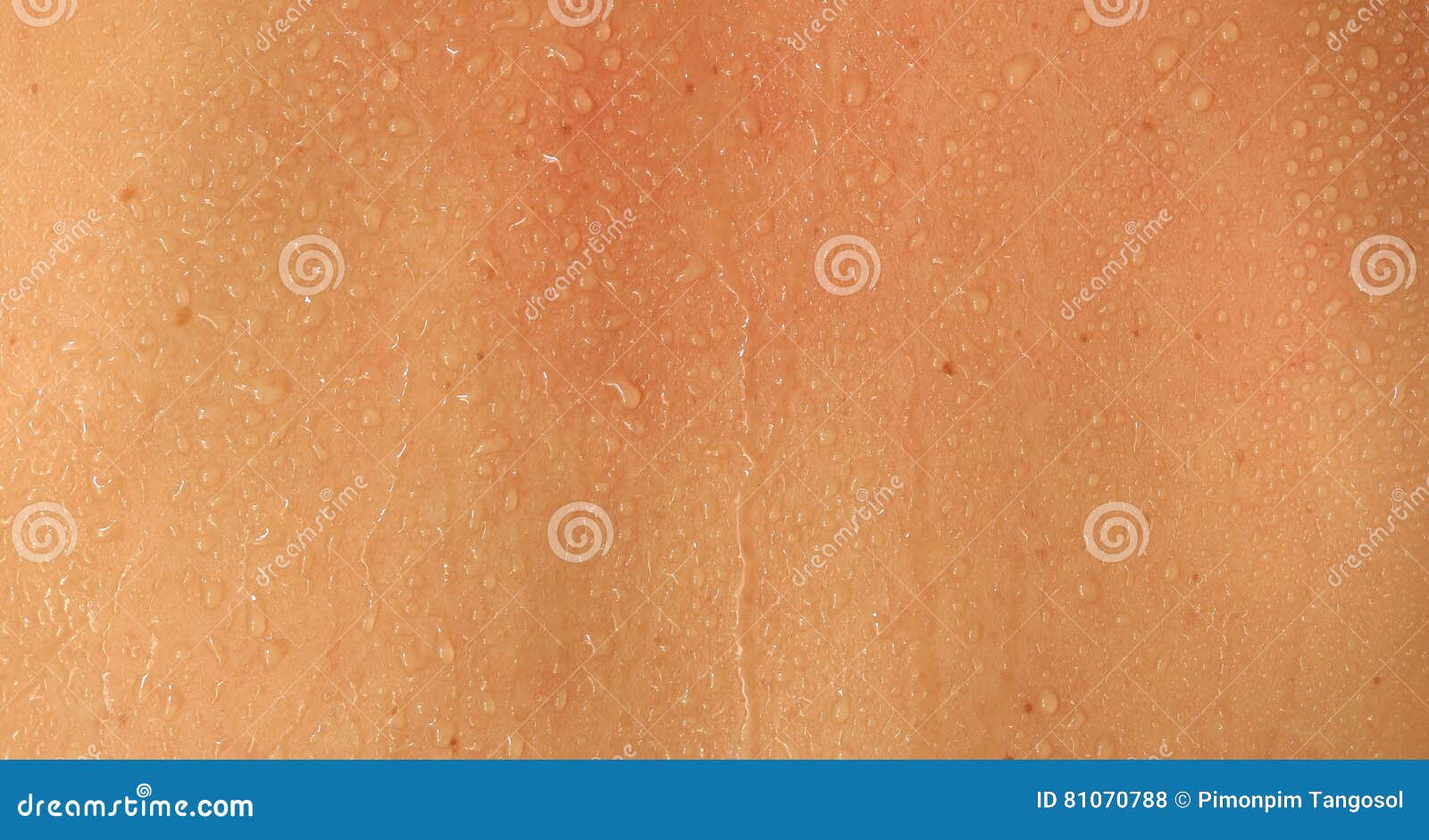 Human Skin and Sweat stock photo. Image of organ, background - 81070788