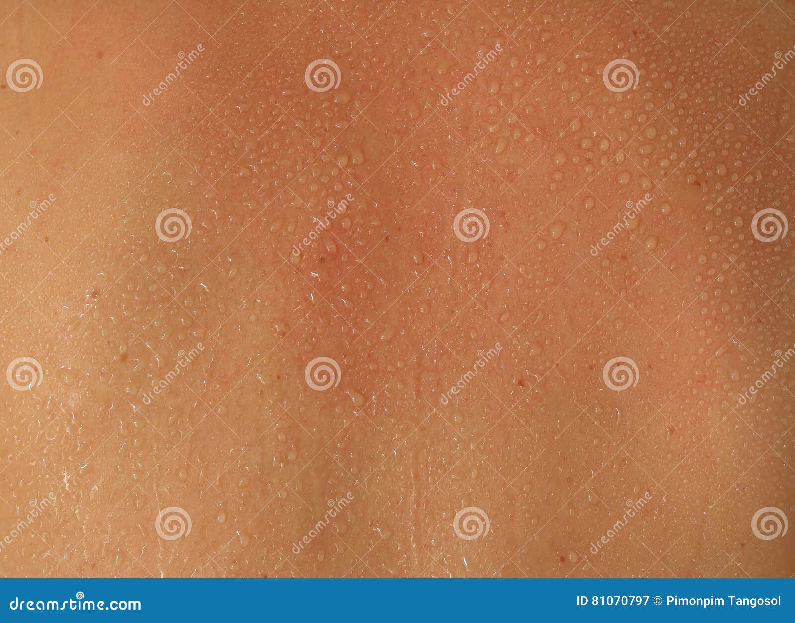 Human Skin and Sweat stock image. Image of person, closeup - 81070797