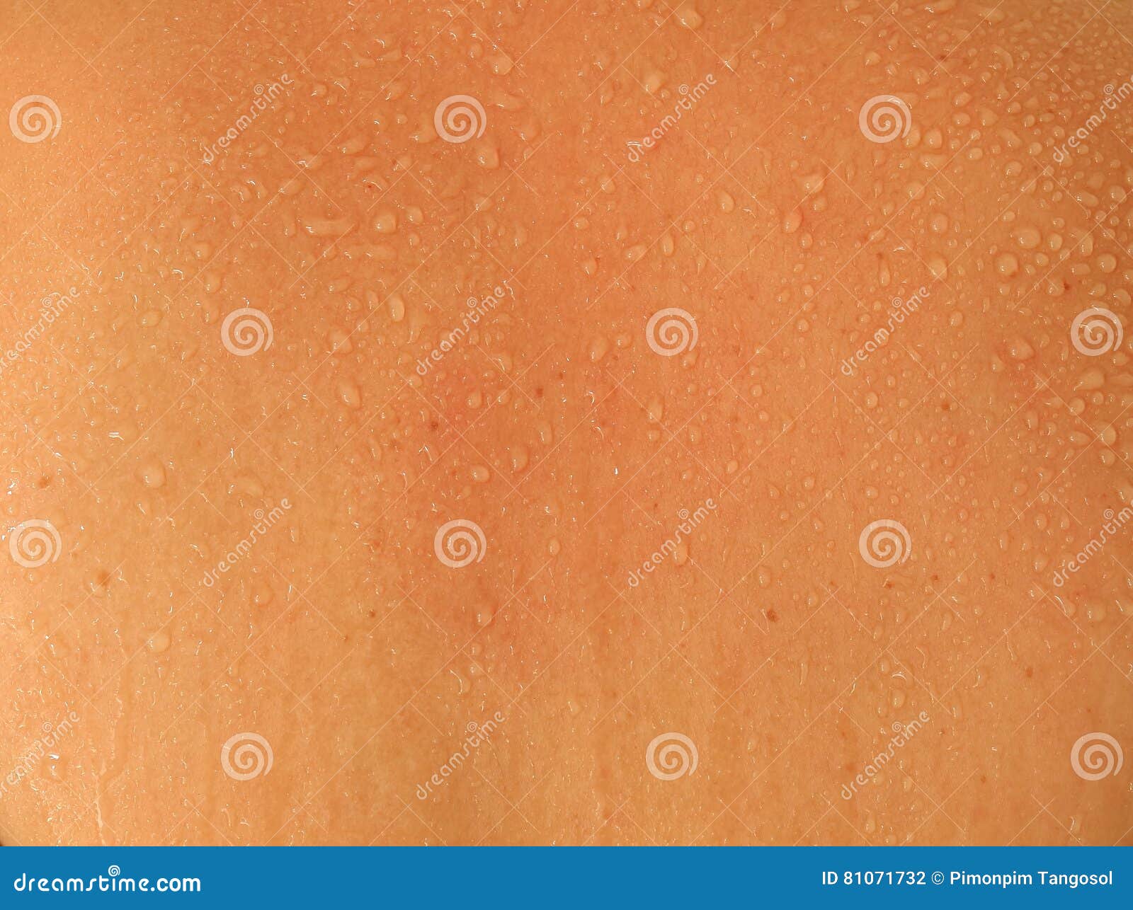 Human Skin and Sweat stock photo. Image of dermatology - 81071732