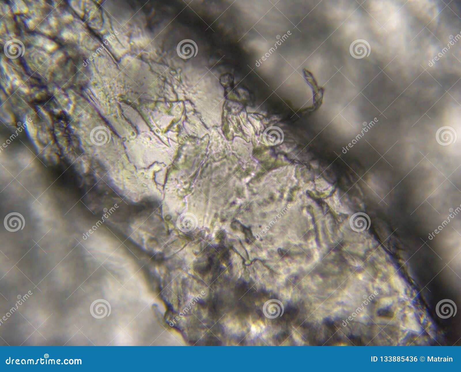 Human Skin Under a Microcope Stock Photo - Image of flake, finger ...