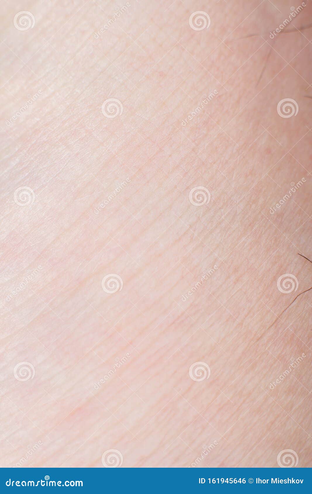 Human Skin with Wounds and without Close Stock Photo - Image of ...