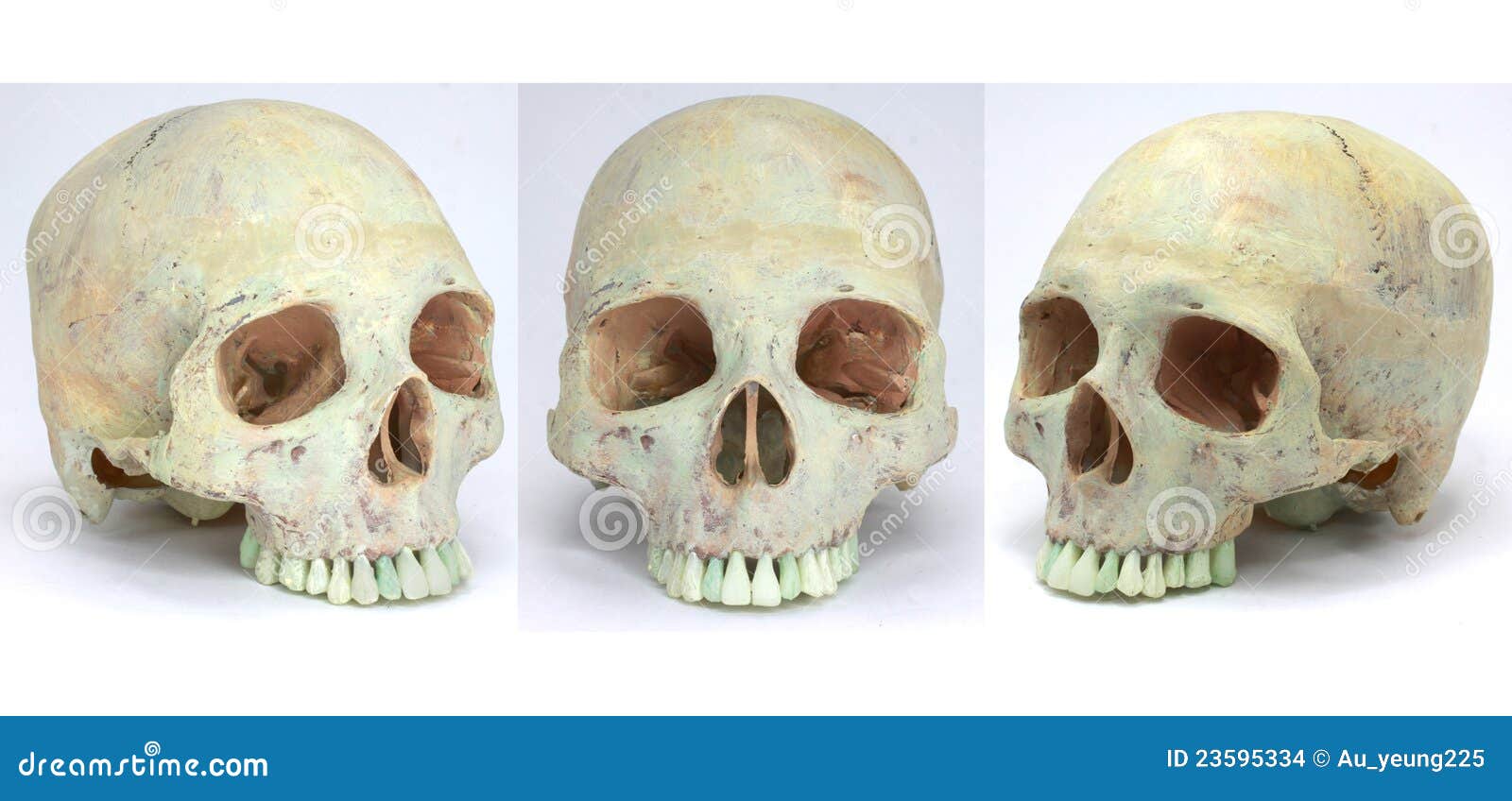 Human Skull stock photo. Image of cranial, teeth, medicine - 23595334