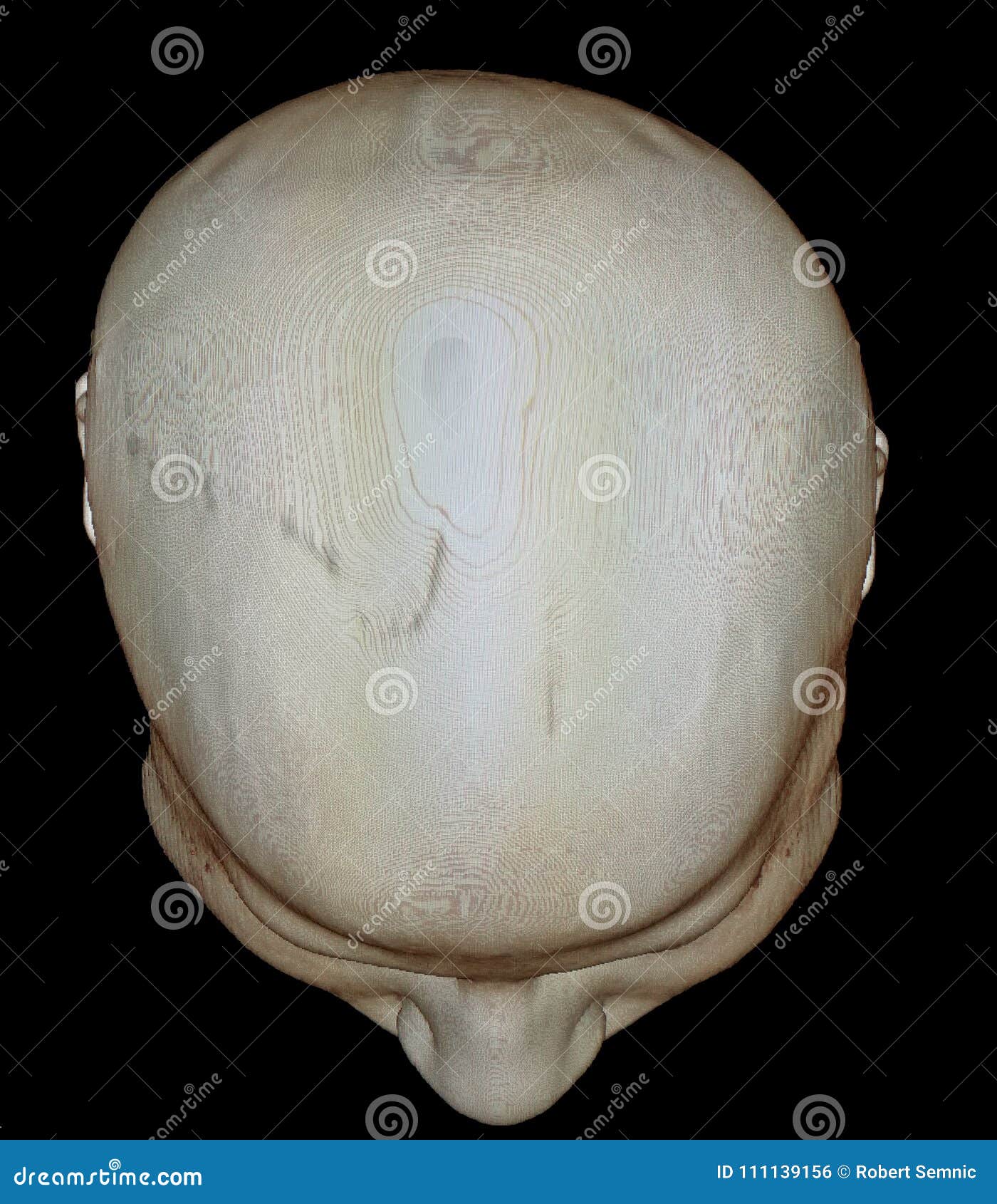 Human Skull from Above, CT Image Stock Photo - Image of diagnostic ...