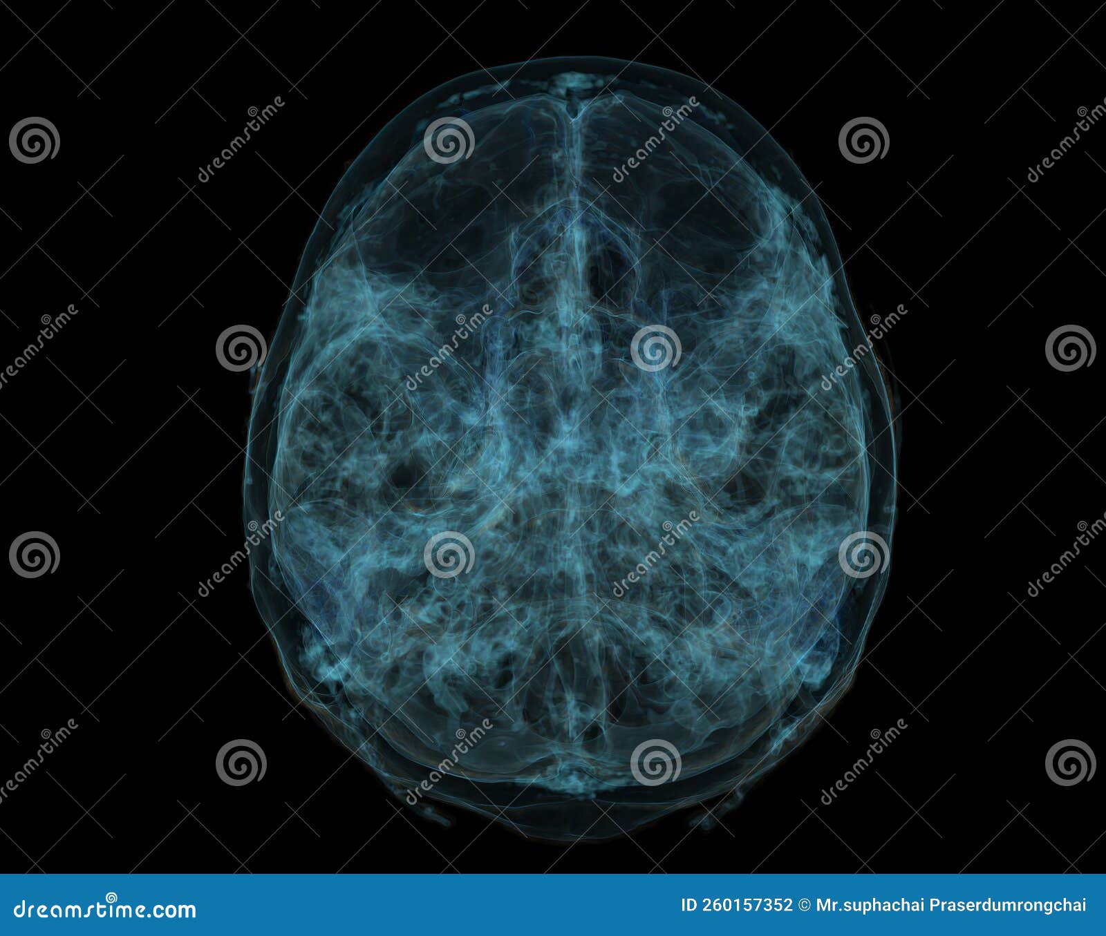 Human Skull, Brain by CT Scan. X-ray Visualization Inside of Skull ...