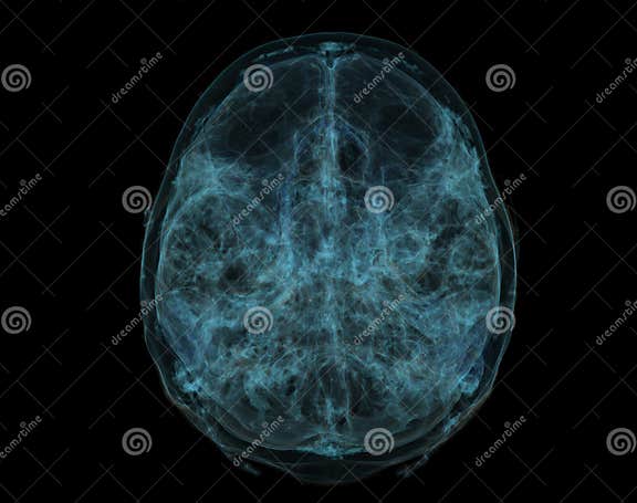 Human Skull, Brain by CT Scan. X-ray Visualization Inside of Skull ...
