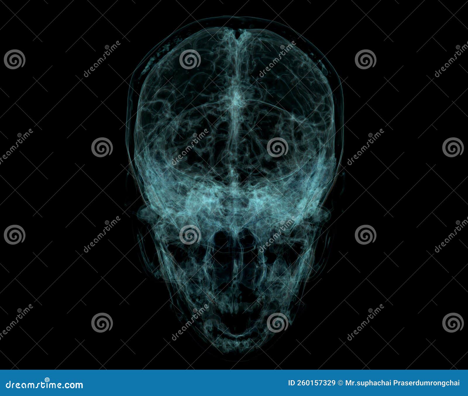 Human Skull, Brain by CT Scan. X-ray Visualization Inside of Skull ... Human Skull, Brain by CT Scan. X-ray Visualization Inside of Skull ...