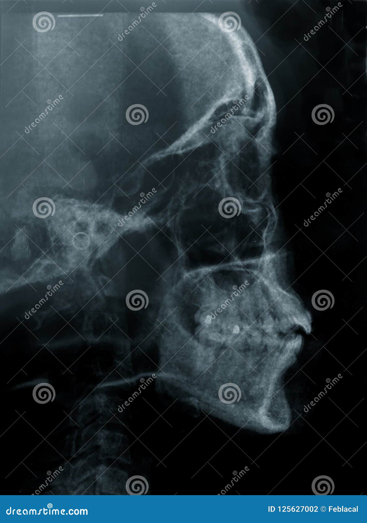 Human skull stock photo. Image of pain, health, checkup - 125627002
