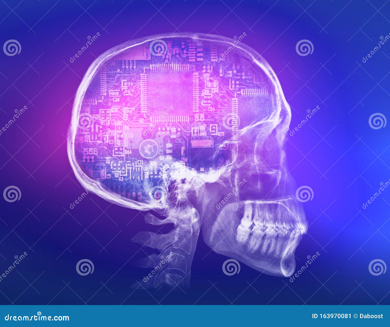 Human Skull X-ray Image. Artificial Intelligence Concept Stock ...