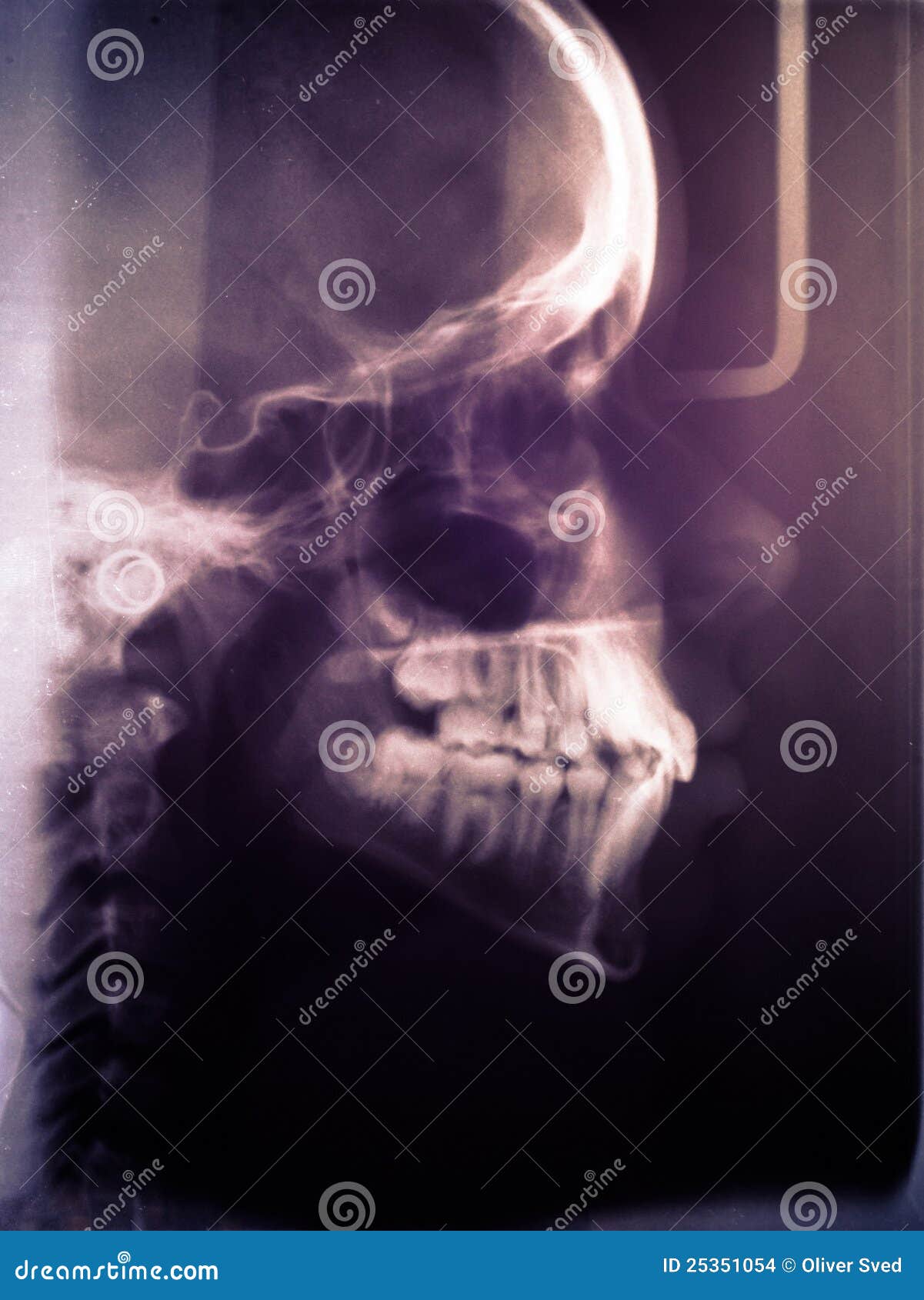 Human skull scan stock photo. Image of mind, medical - 25351054