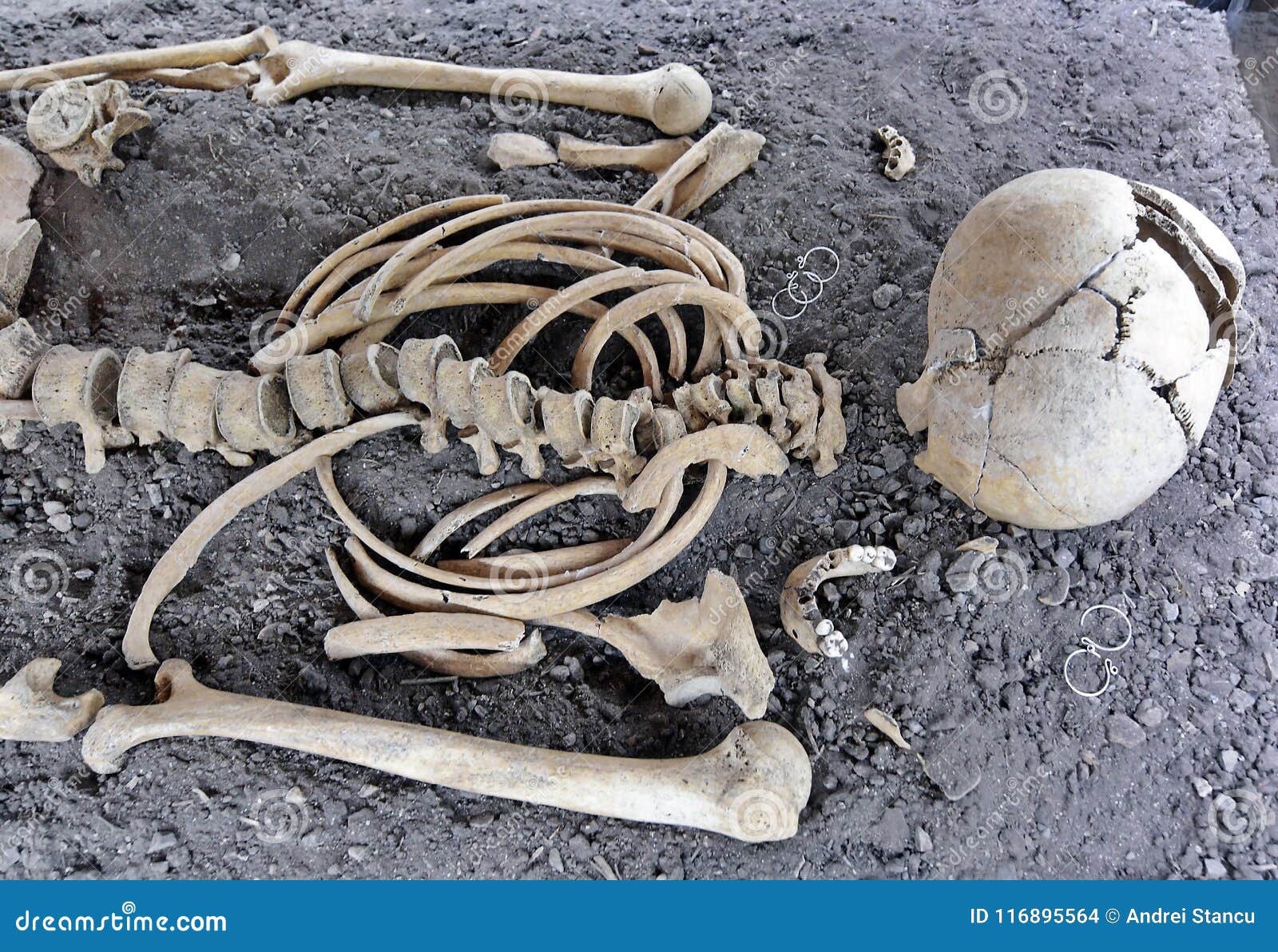 Human Skull and Skeleton Bones Stock Photo - Image of archeology ...