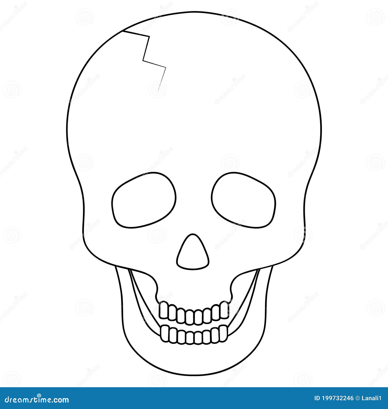 Human Skull. Sketch. Crack in the Forehead. Vector Illustration. Bone ...