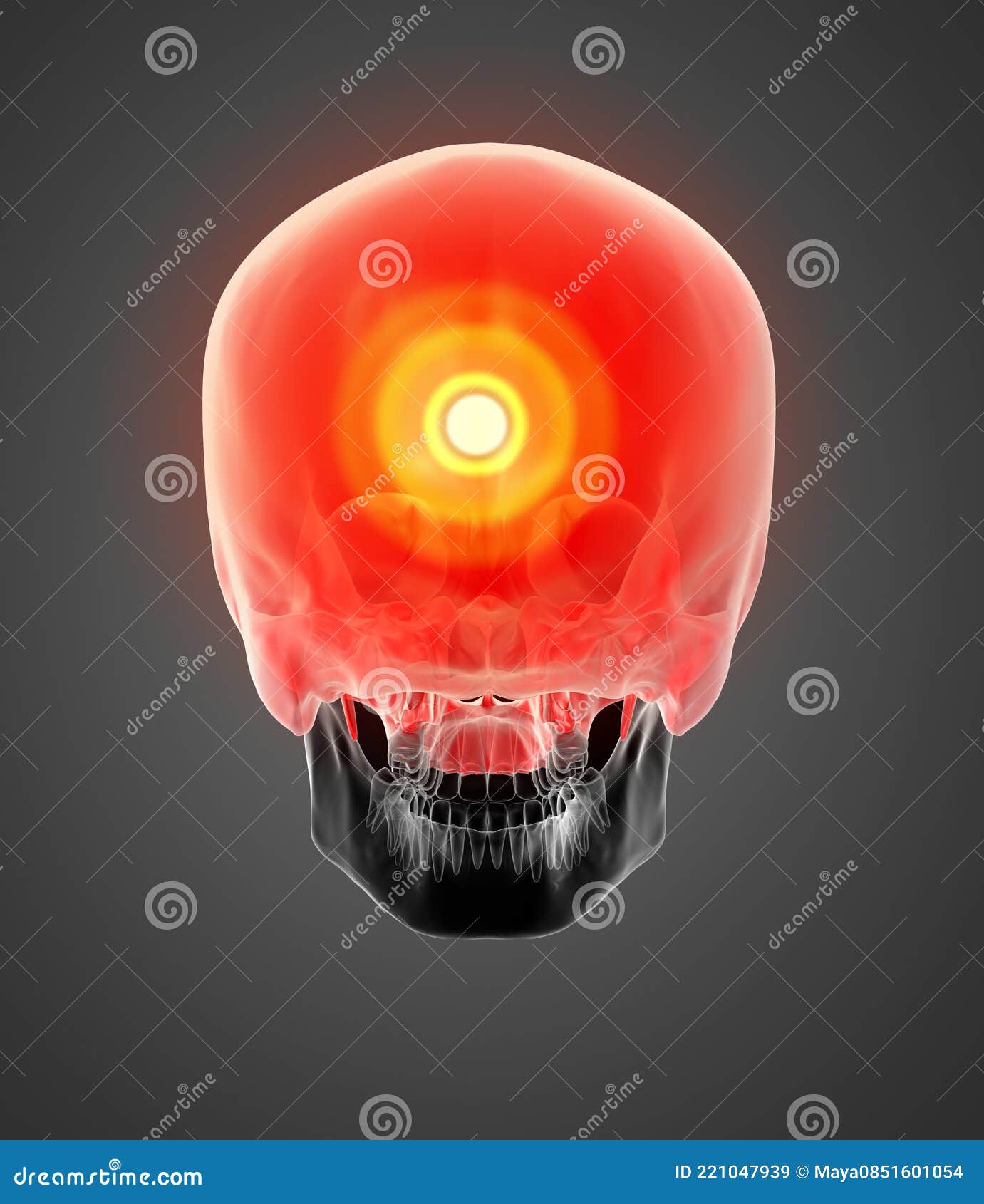 Human Skull. Upper half stock illustration. Illustration of science ...