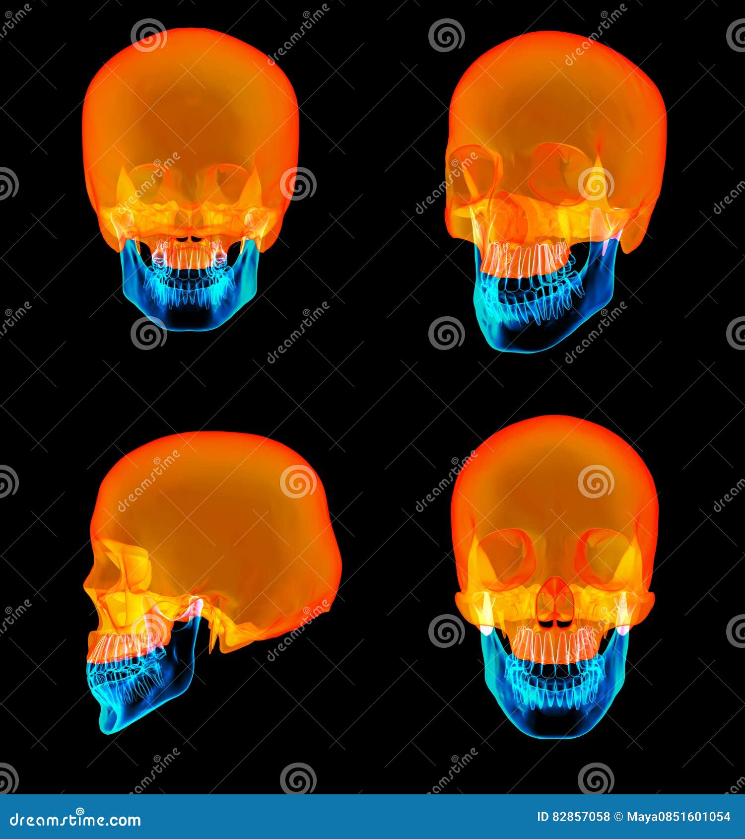 Human Skull Upper half stock illustration. Illustration of anatomy ...