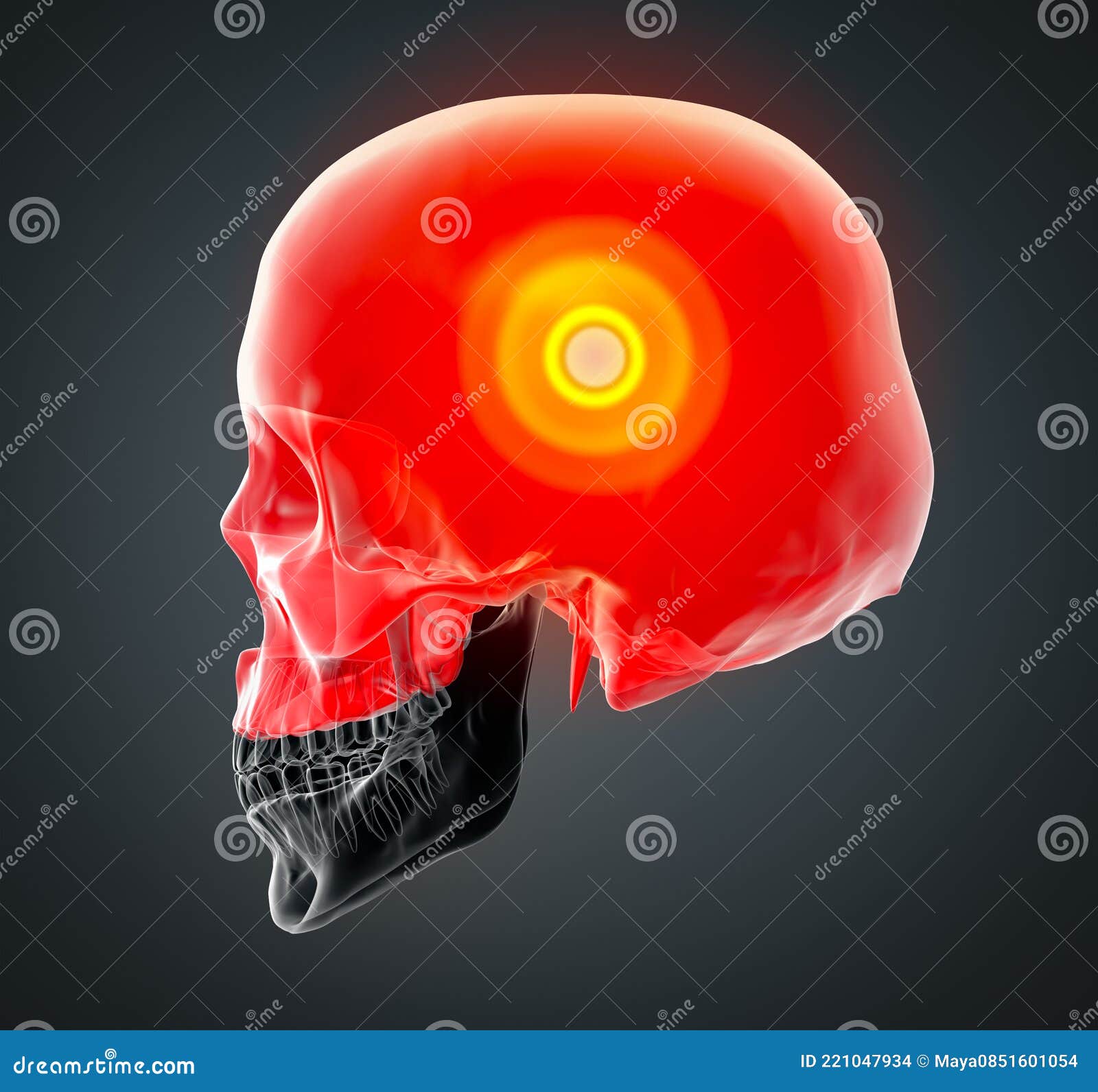 Human Skull. Upper Half Stock Photography | CartoonDealer.com #221047934