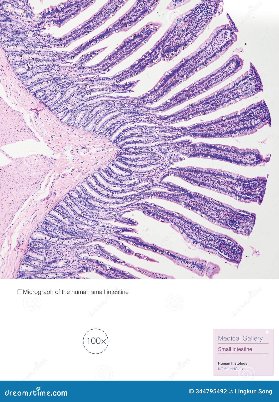 Human Small Intestine Anatomical Model On White Background Royalty-Free ...