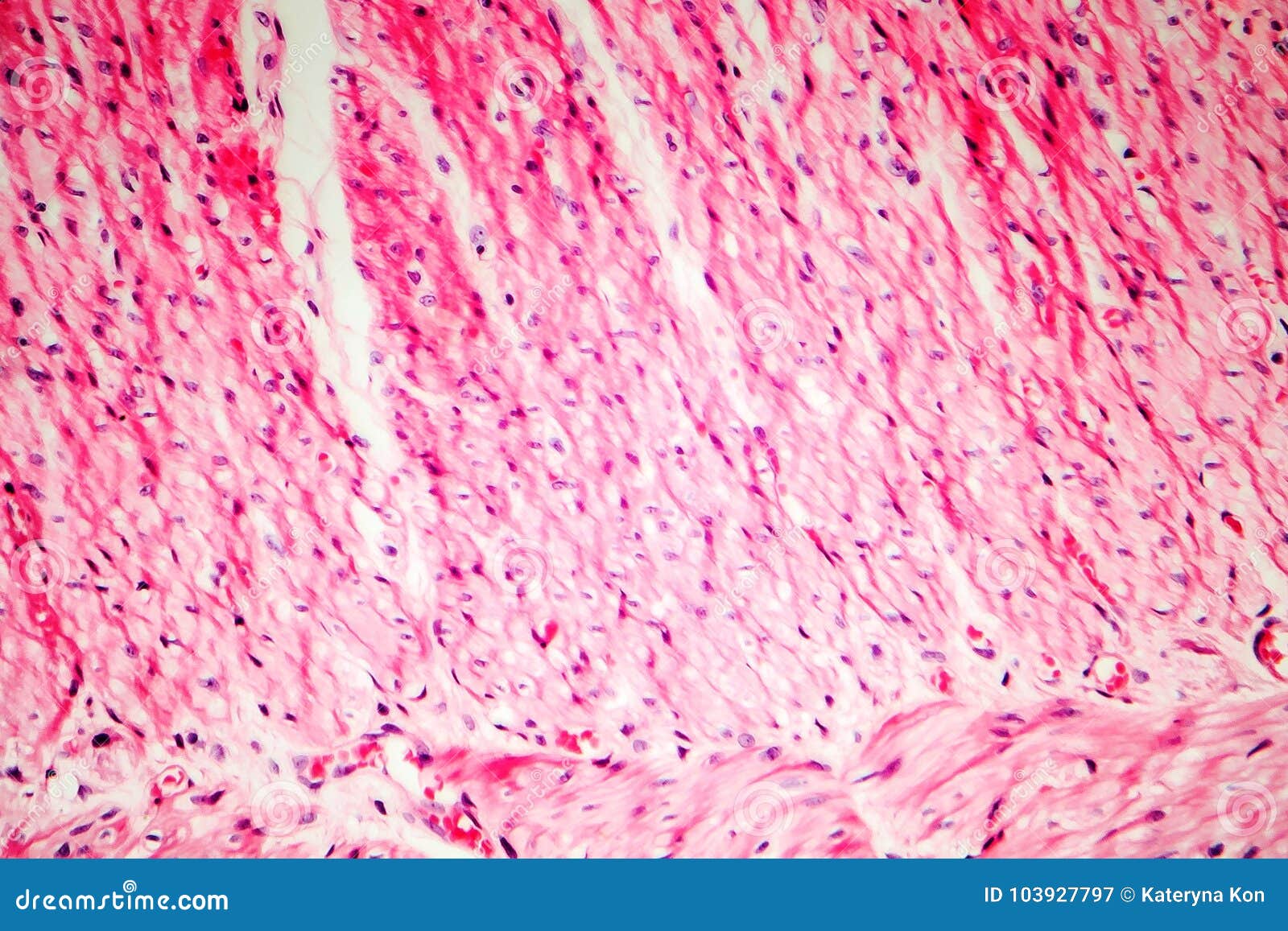 Human smooth muscle stock image. Image of muscle, photomicrograph ...